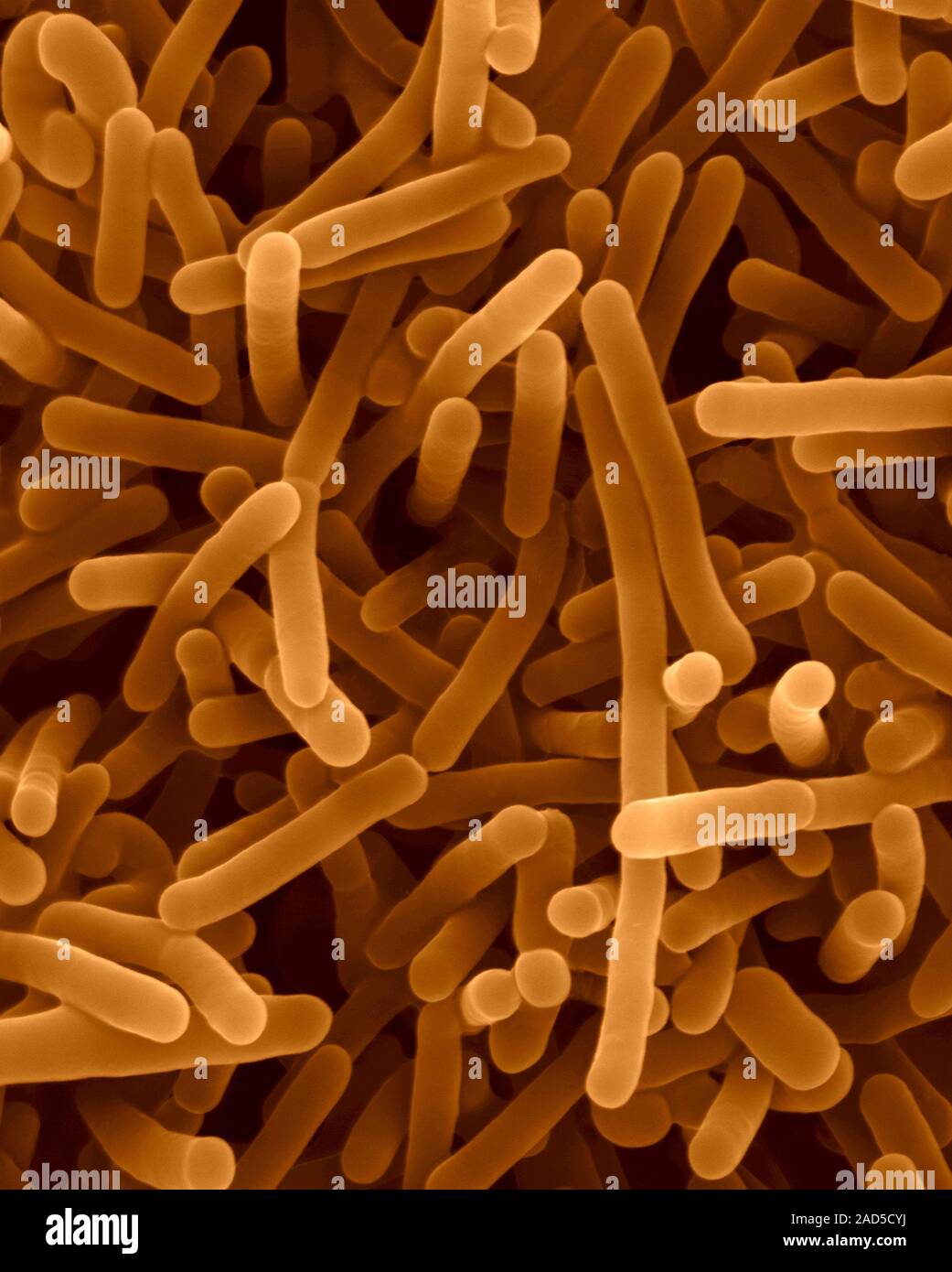 Coloured scanning electron micrograph (SEM) of Listeria monocytogenes ...