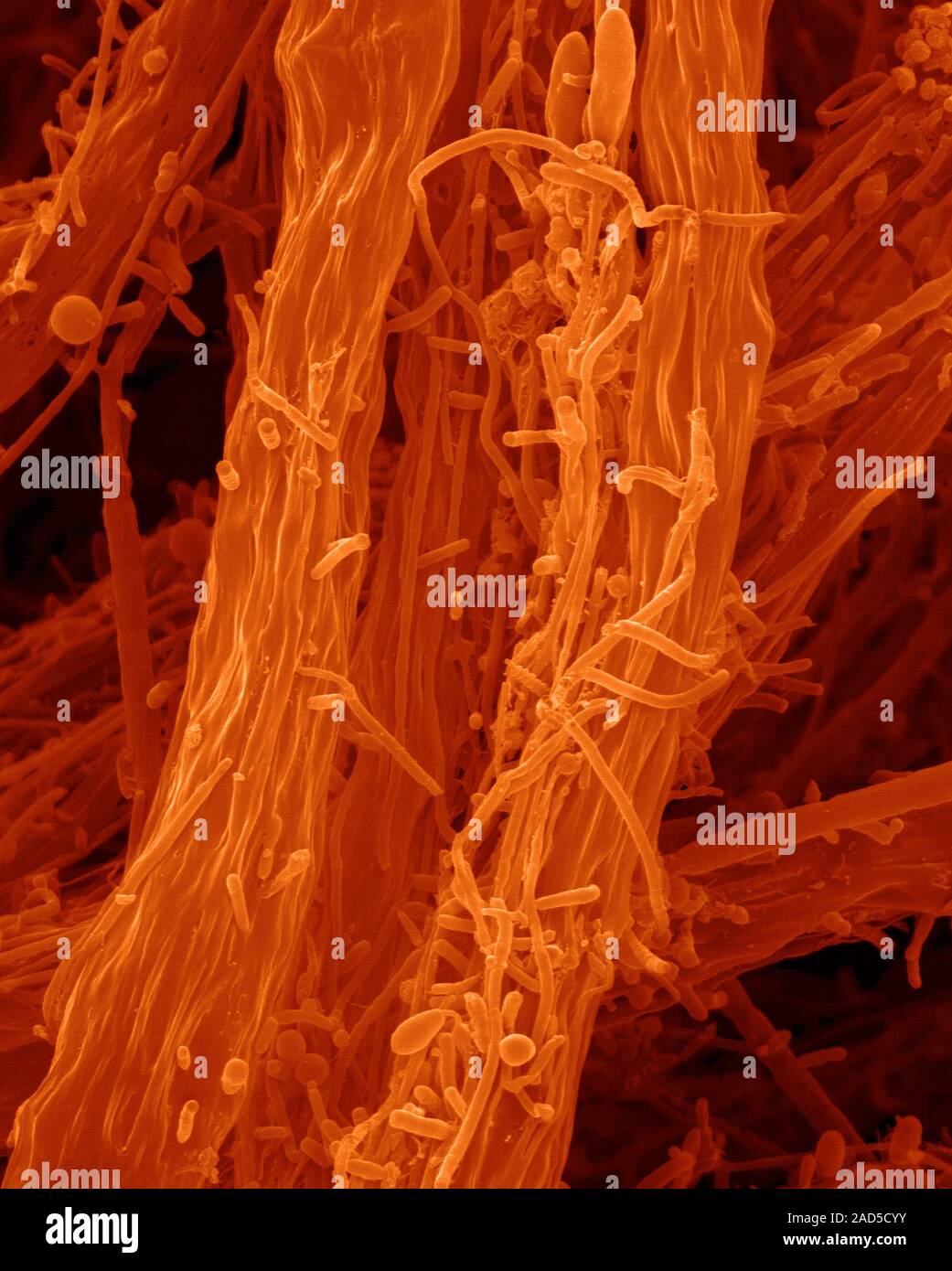 Coloured scanning electron micrograph (SEM) of Filamentous iron ...