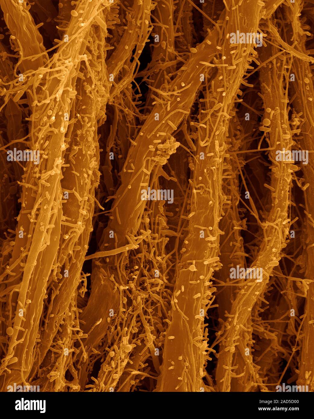 Coloured scanning electron micrograph (SEM) of Filamentous iron ...