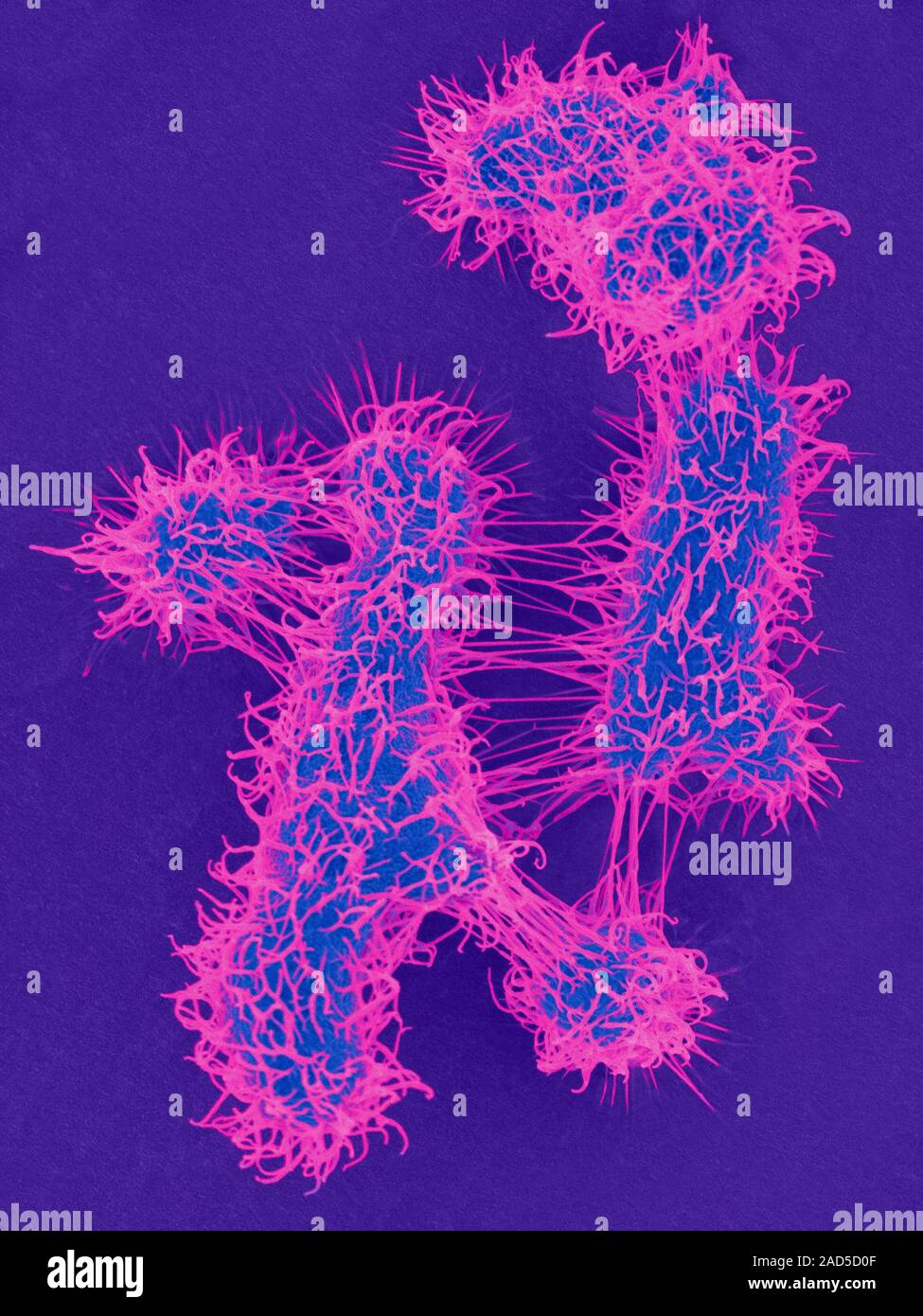 Coloured scanning electron micrograph (SEM) of Labrys wisconsinensis ...
