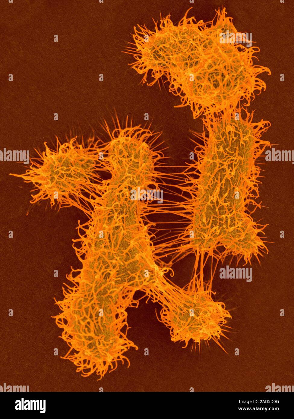 Coloured scanning electron micrograph (SEM) of Labrys wisconsinensis ...