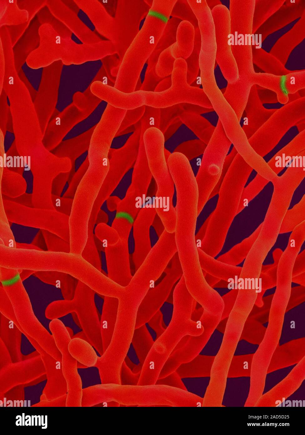 Coloured scanning electron micrograph (SEM) of Streptomyces ...