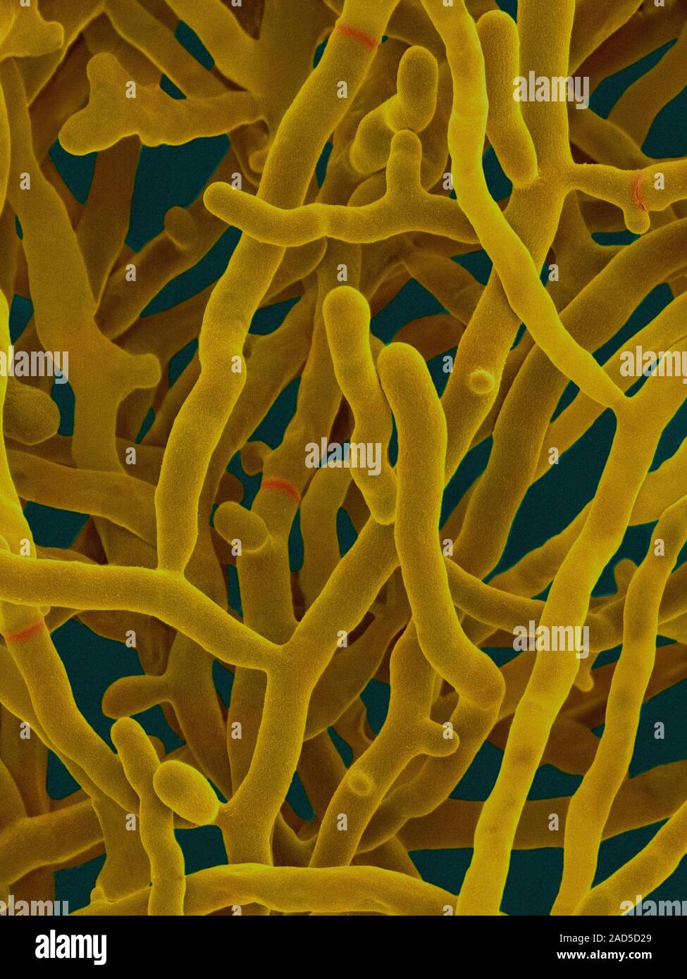 Coloured scanning electron micrograph (SEM) of Streptomyces ...