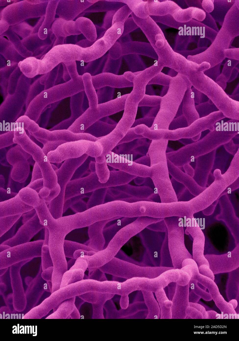 Coloured scanning electron micrograph (SEM) of Streptomyces mashuensis ...