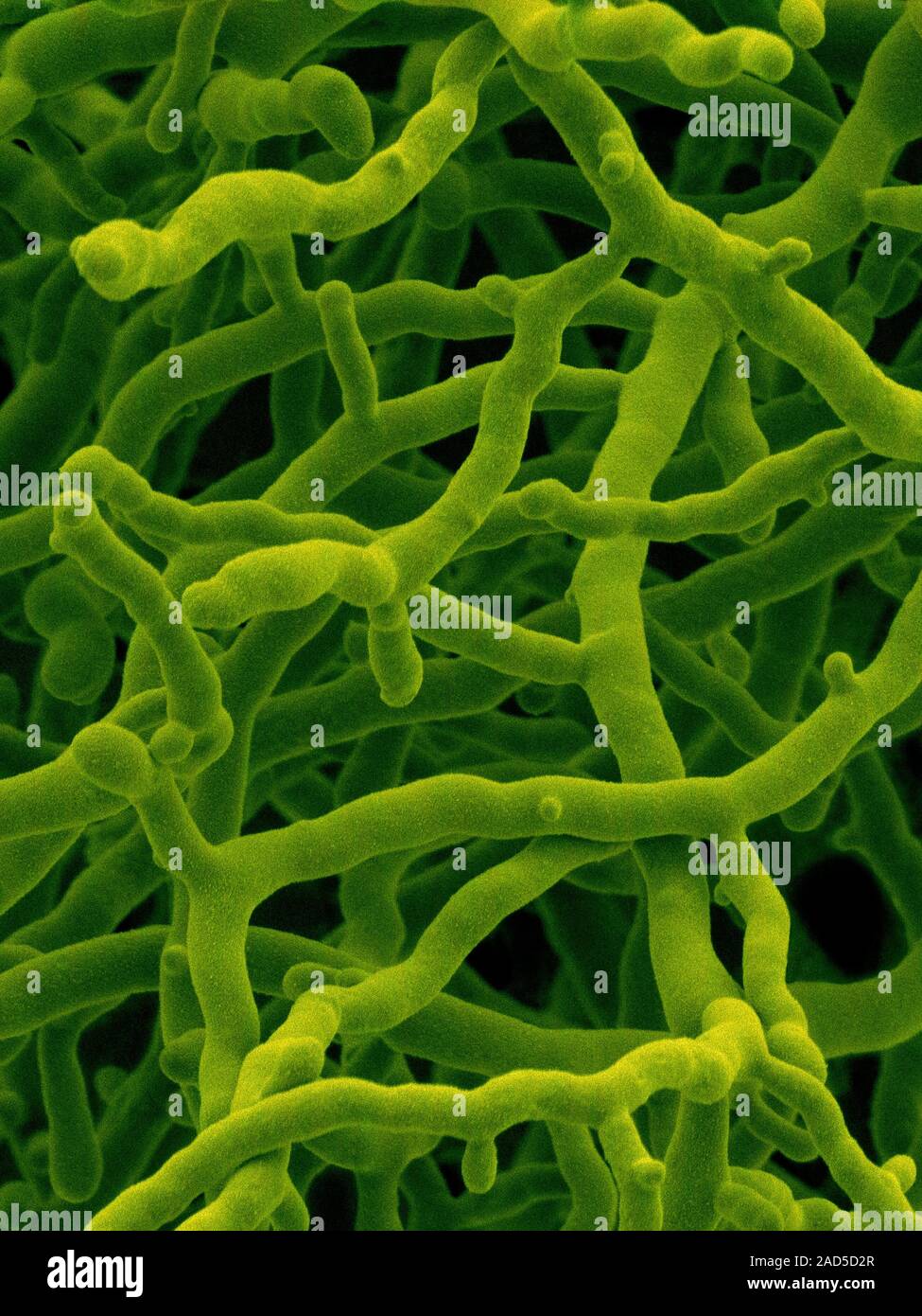 Coloured scanning electron micrograph (SEM) of Streptomyces mashuensis ...