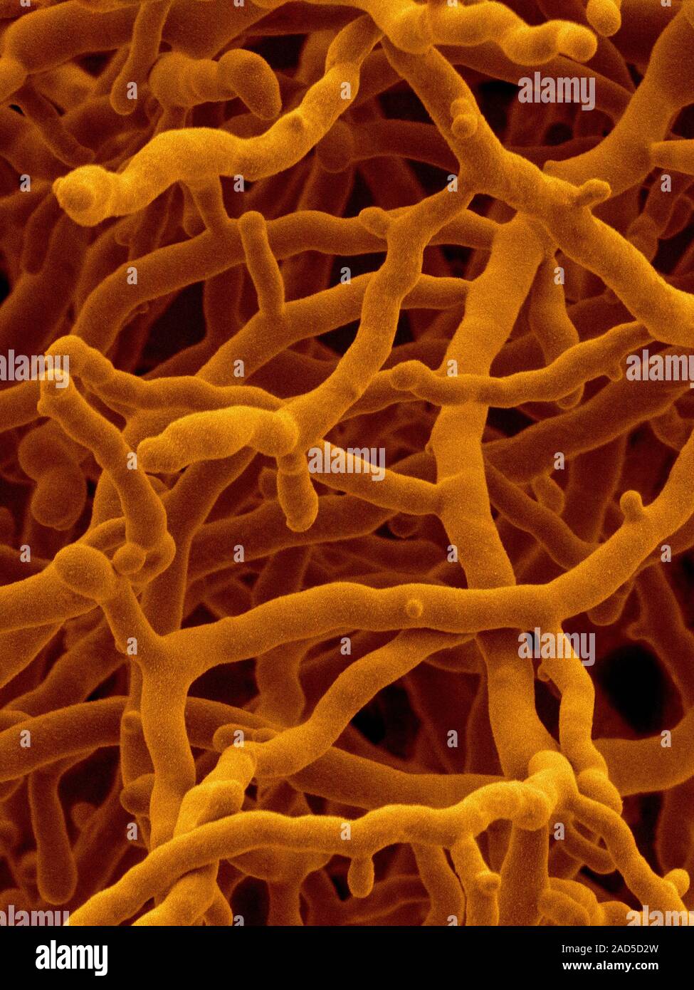 Coloured scanning electron micrograph (SEM) of Streptomyces mashuensis ...