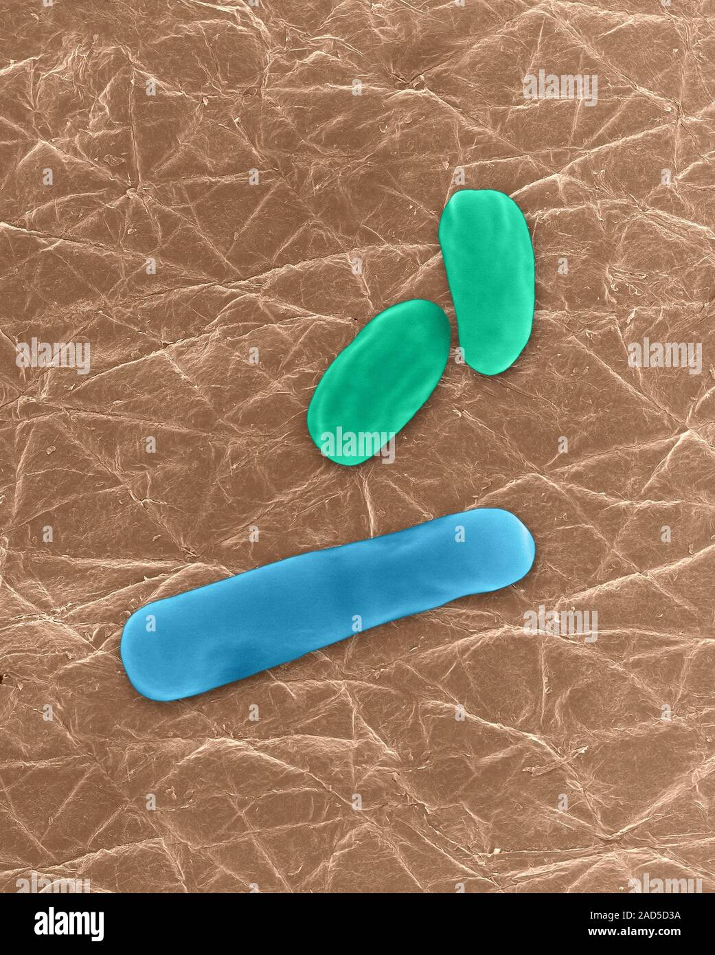 Coloured scanning electron micrograph (SEM) of Bacillus anthracis spore ...