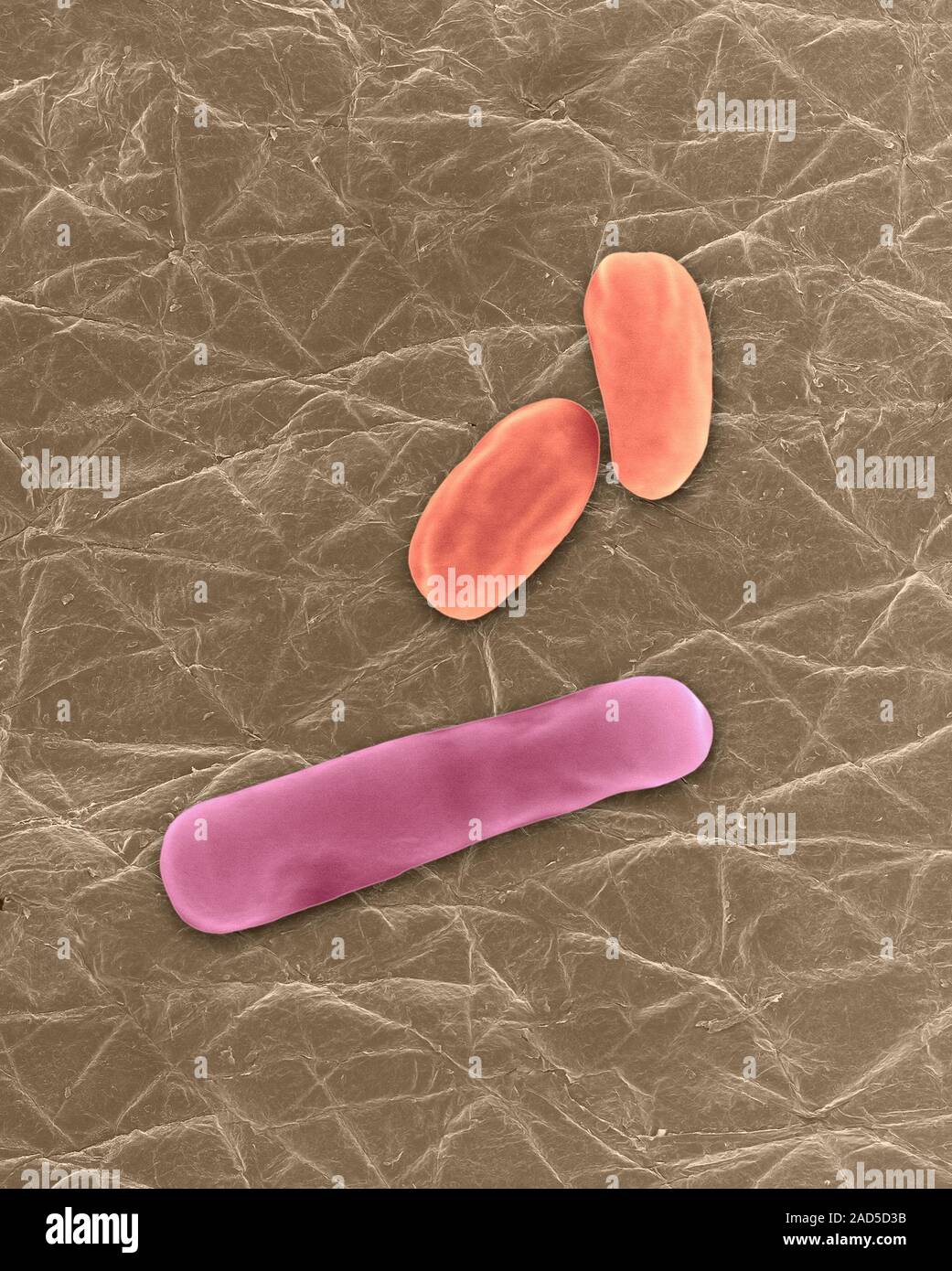 Coloured scanning electron micrograph (SEM) of Bacillus anthracis spore ...