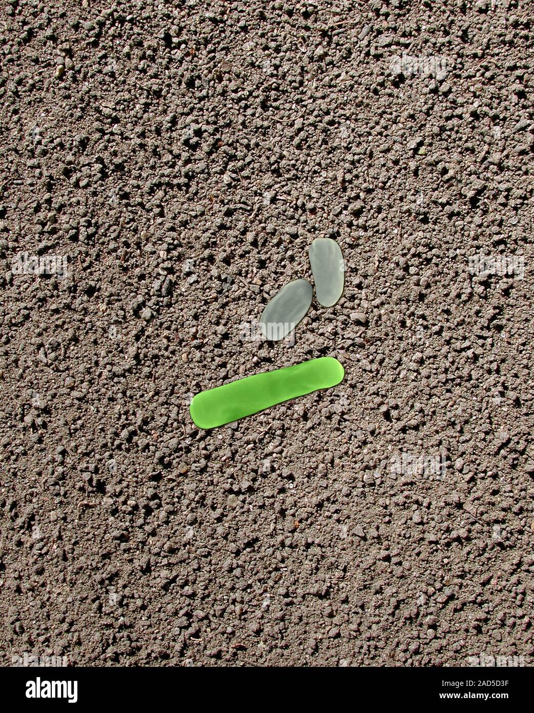 Coloured scanning electron micrograph (SEM) of Bacillus anthracis spore ...