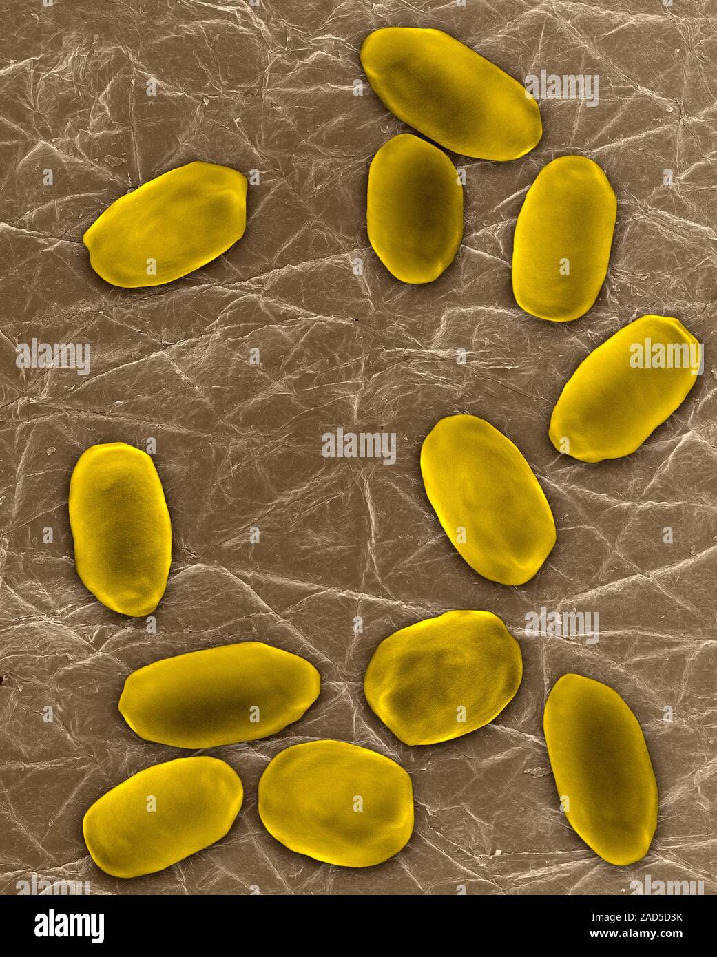 Coloured scanning electron micrograph (SEM) of Bacillus anthracis ...