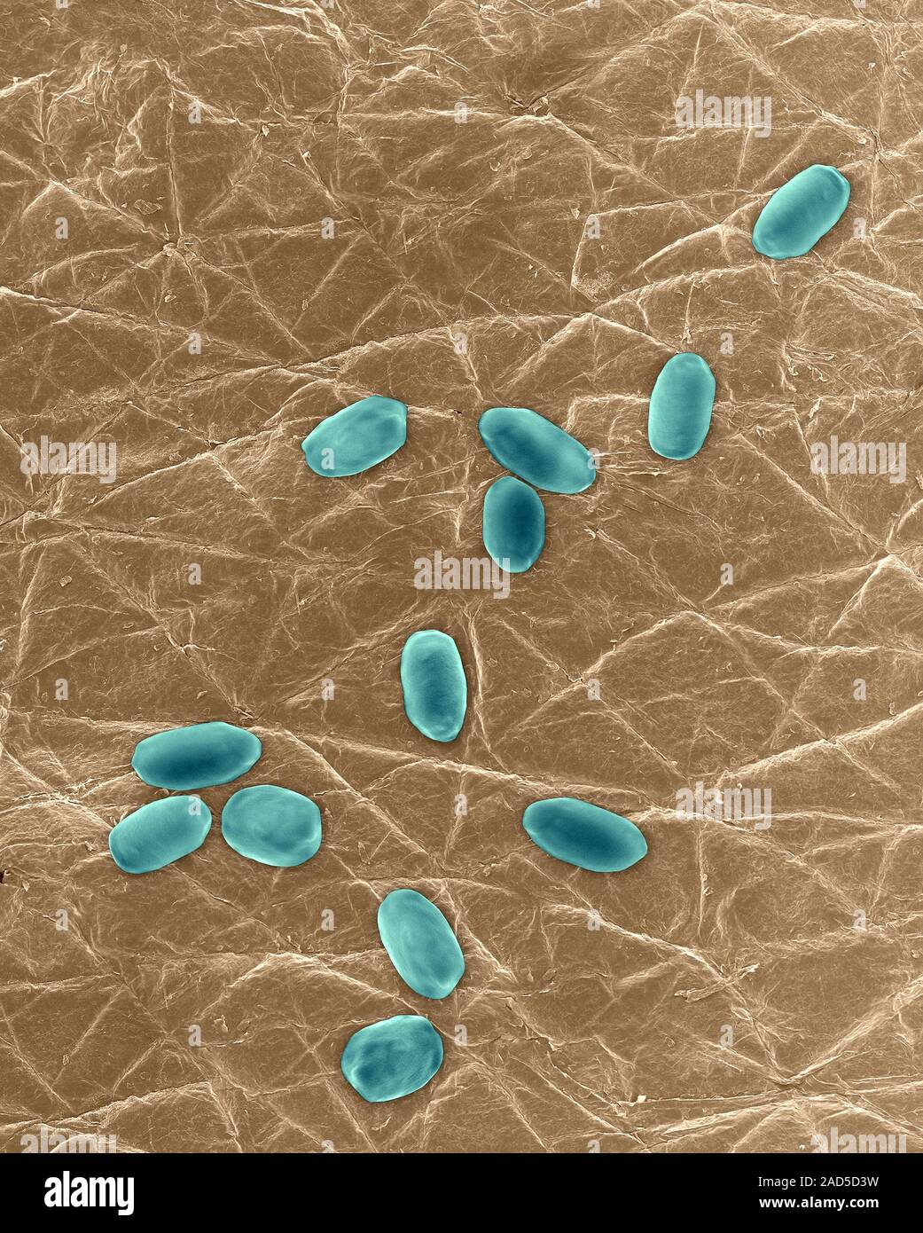 Coloured scanning electron micrograph (SEM) of Bacillus anthracis ...