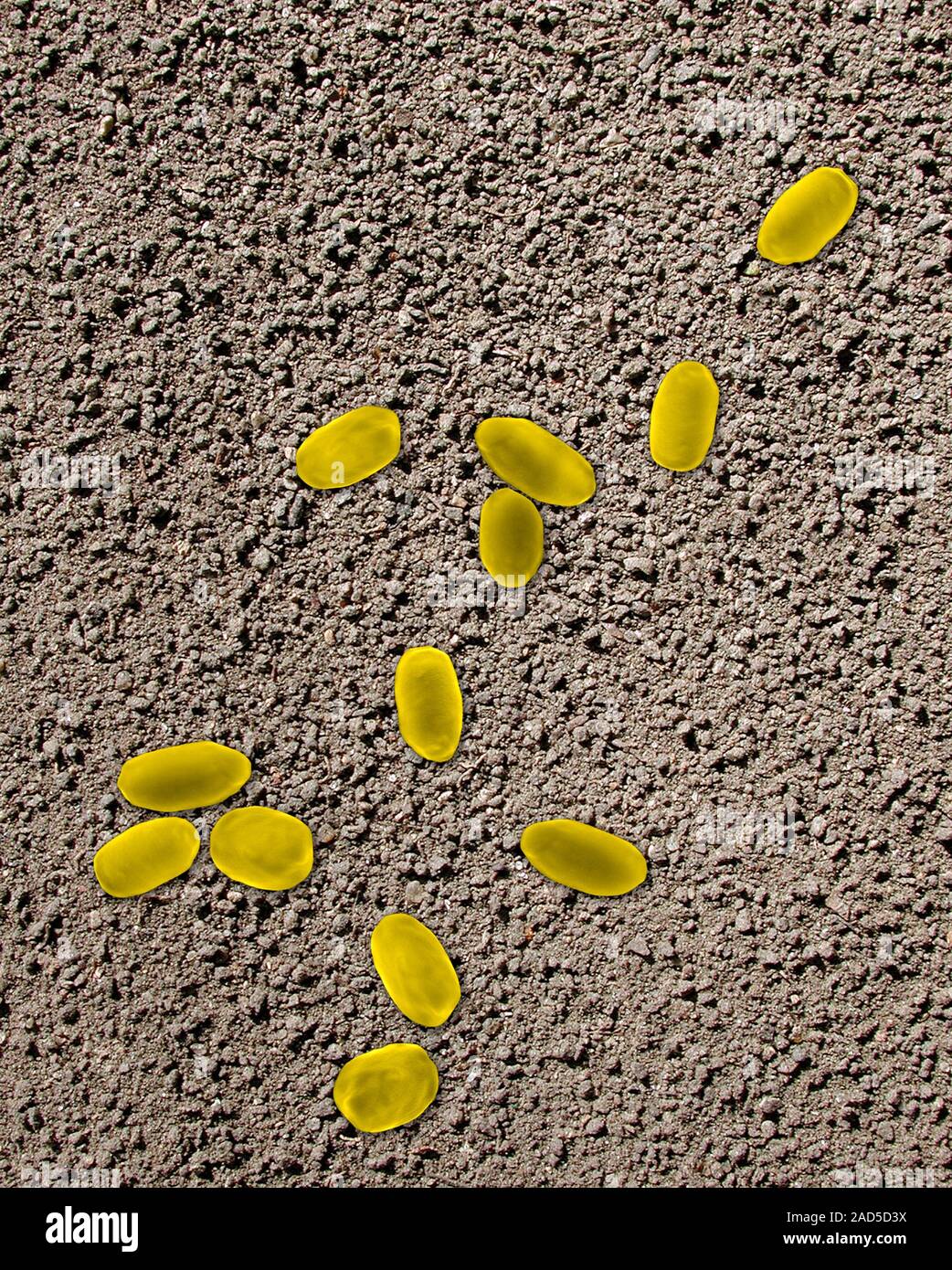 Coloured scanning electron micrograph (SEM) of Bacillus anthracis ...