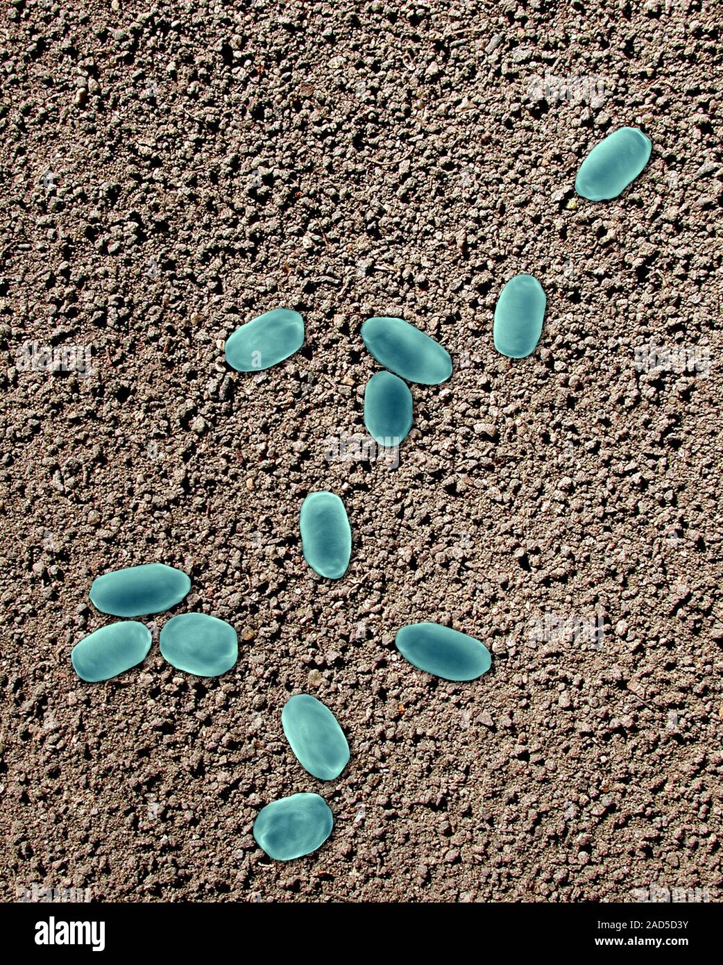 Coloured scanning electron micrograph (SEM) of Bacillus anthracis ...