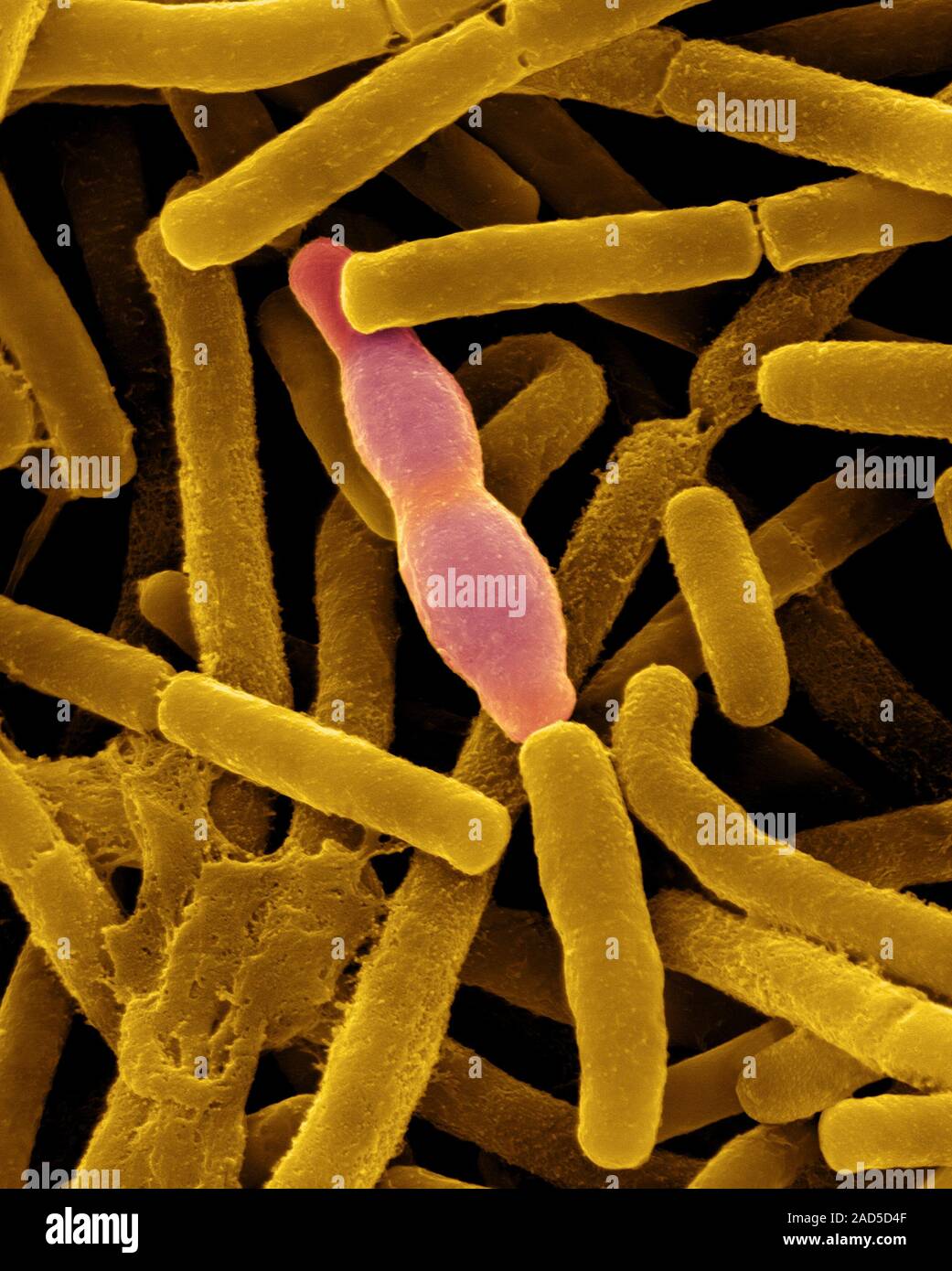 Coloured scanning electron micrograph (SEM) of Bacillus anthracis ...