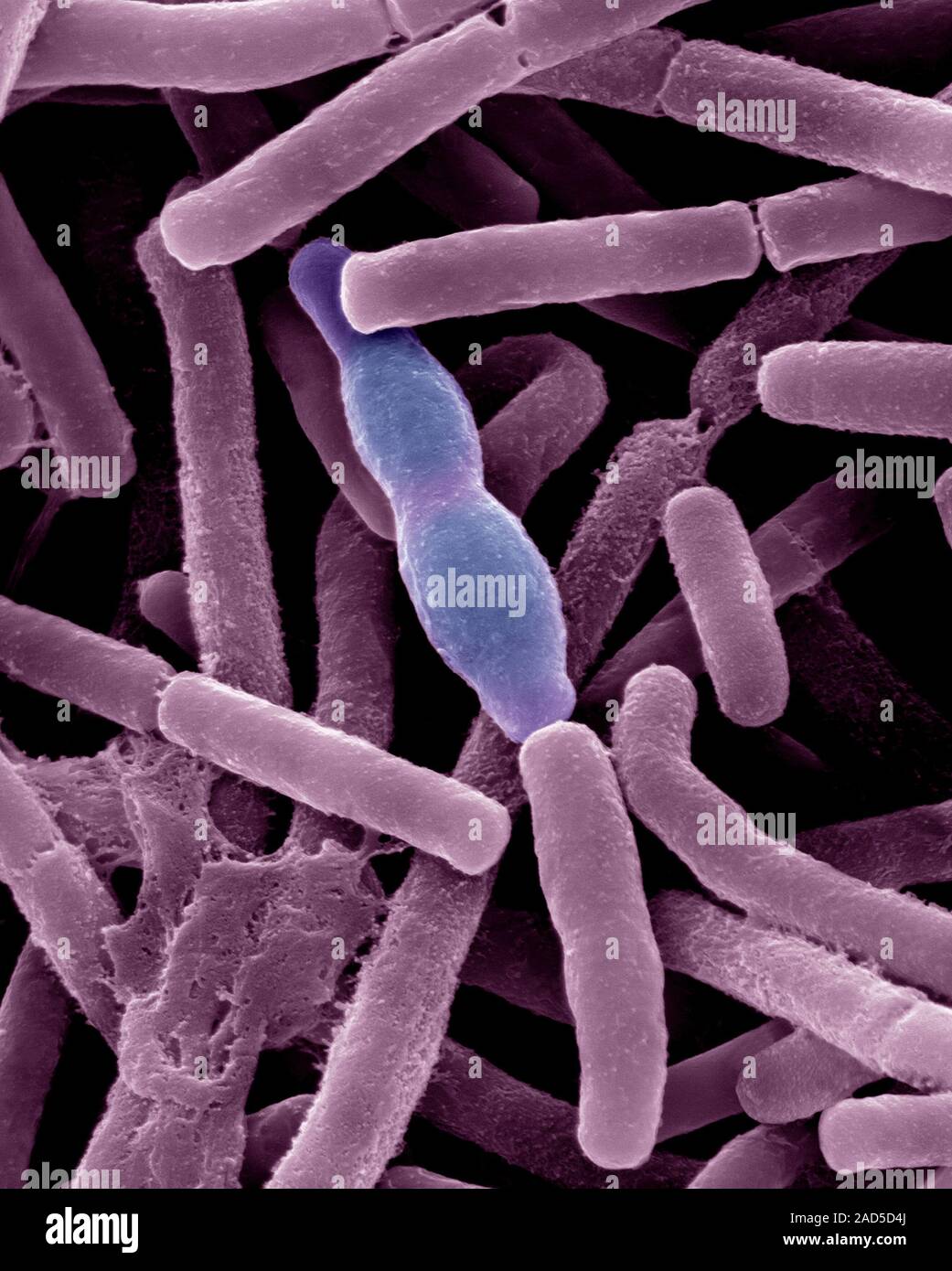 Coloured scanning electron micrograph (SEM) of Bacillus anthracis ...