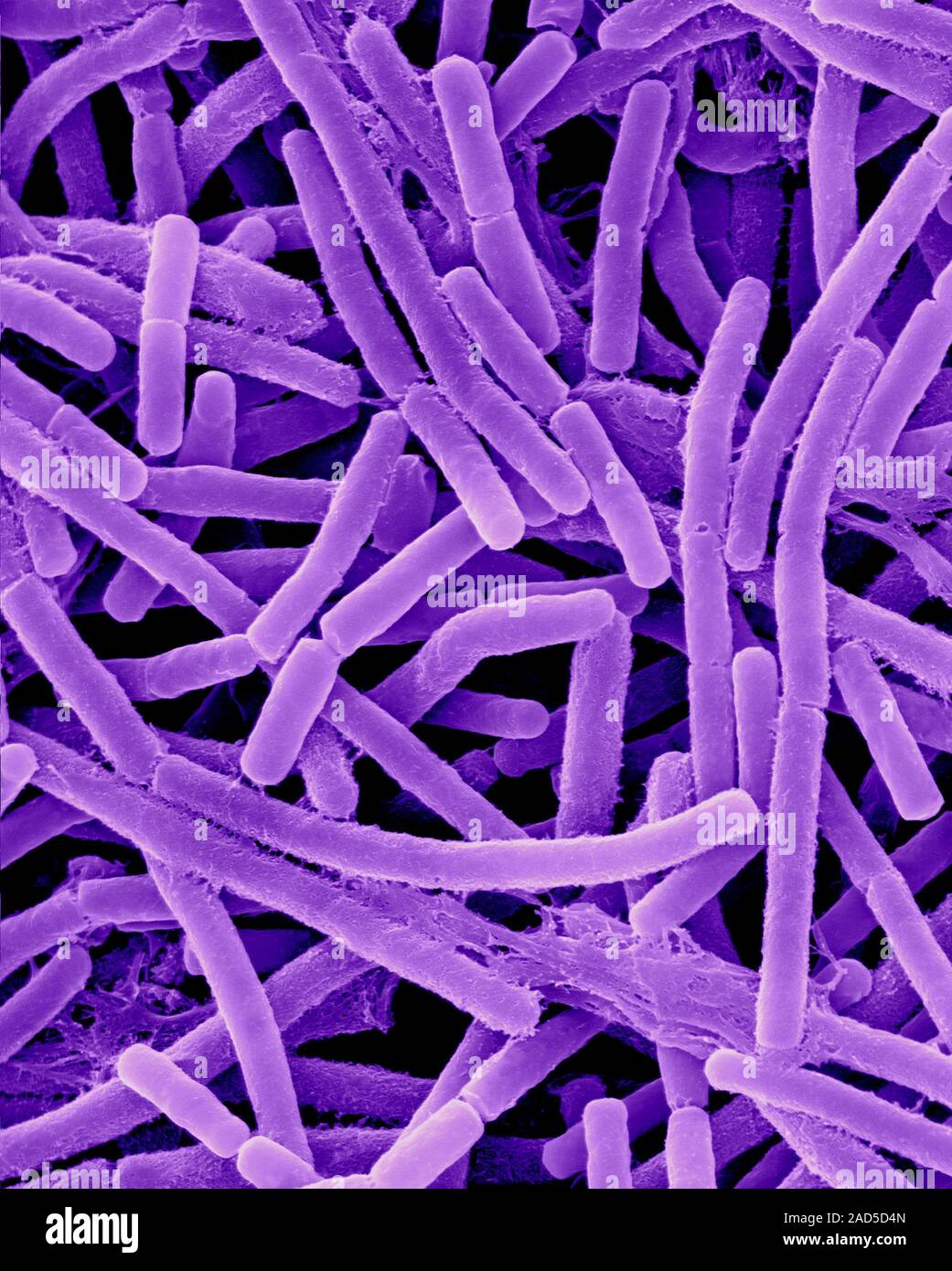 Coloured scanning electron micrograph (SEM) of Bacillus anthracis ...