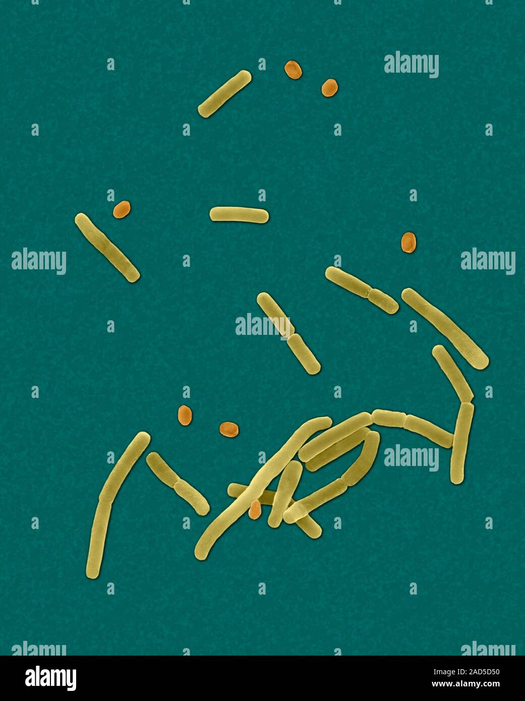 Coloured scanning electron micrograph (SEM) of Bacillus anthracis spore ...