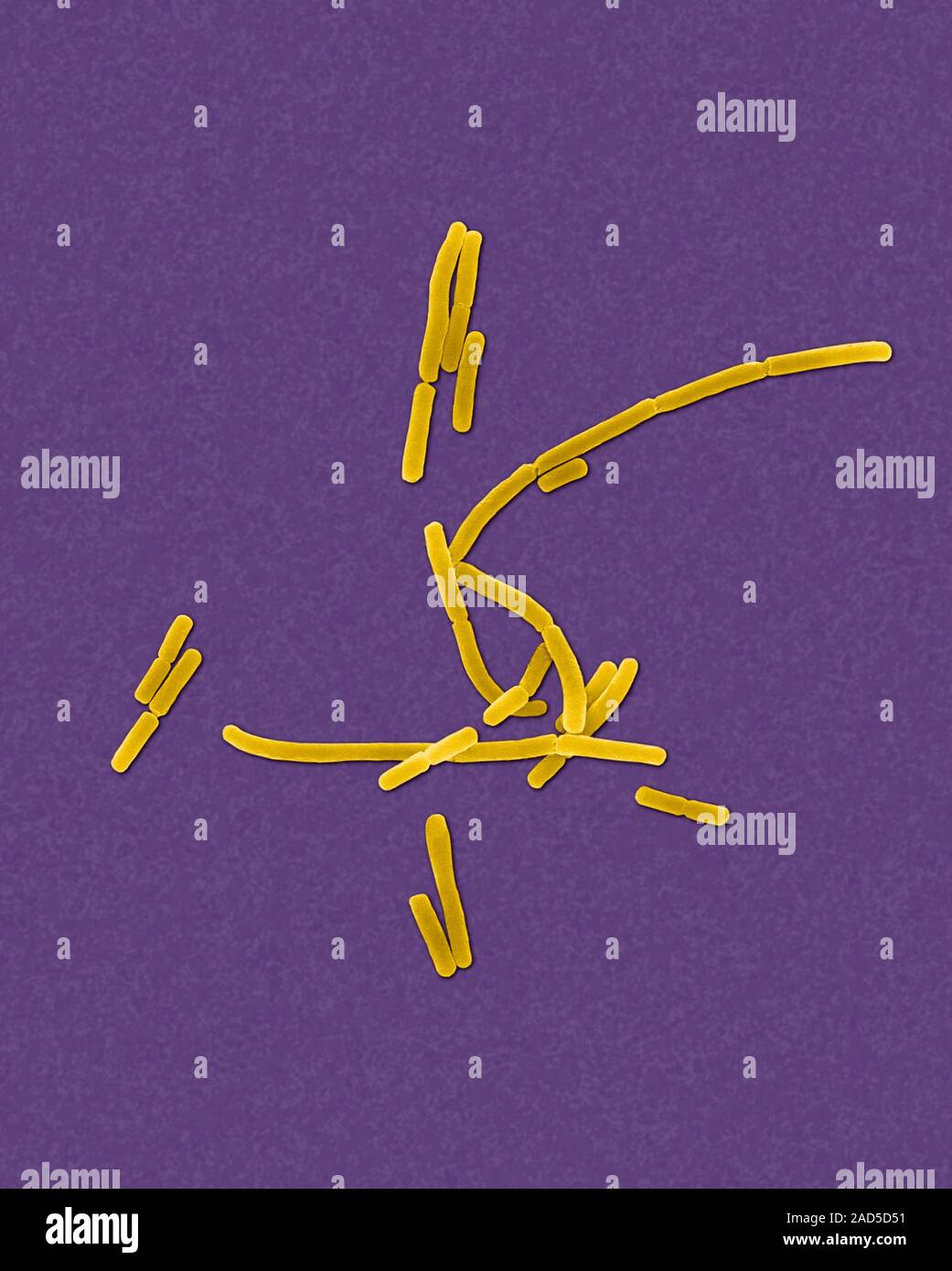 Coloured scanning electron micrograph (SEM) of Bacillus anthracis ...