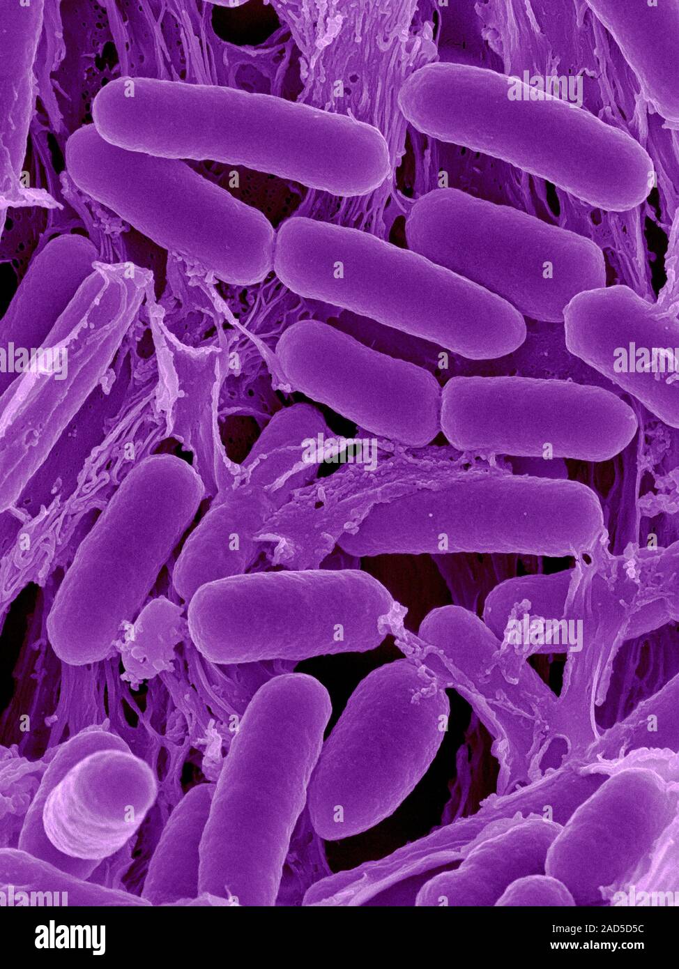 Coloured scanning electron micrograph (SEM) of Escherichia hermannii ...