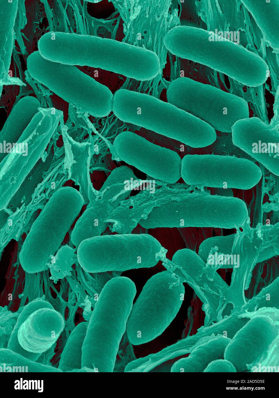 Coloured scanning electron micrograph (SEM) of Escherichia hermannii ...