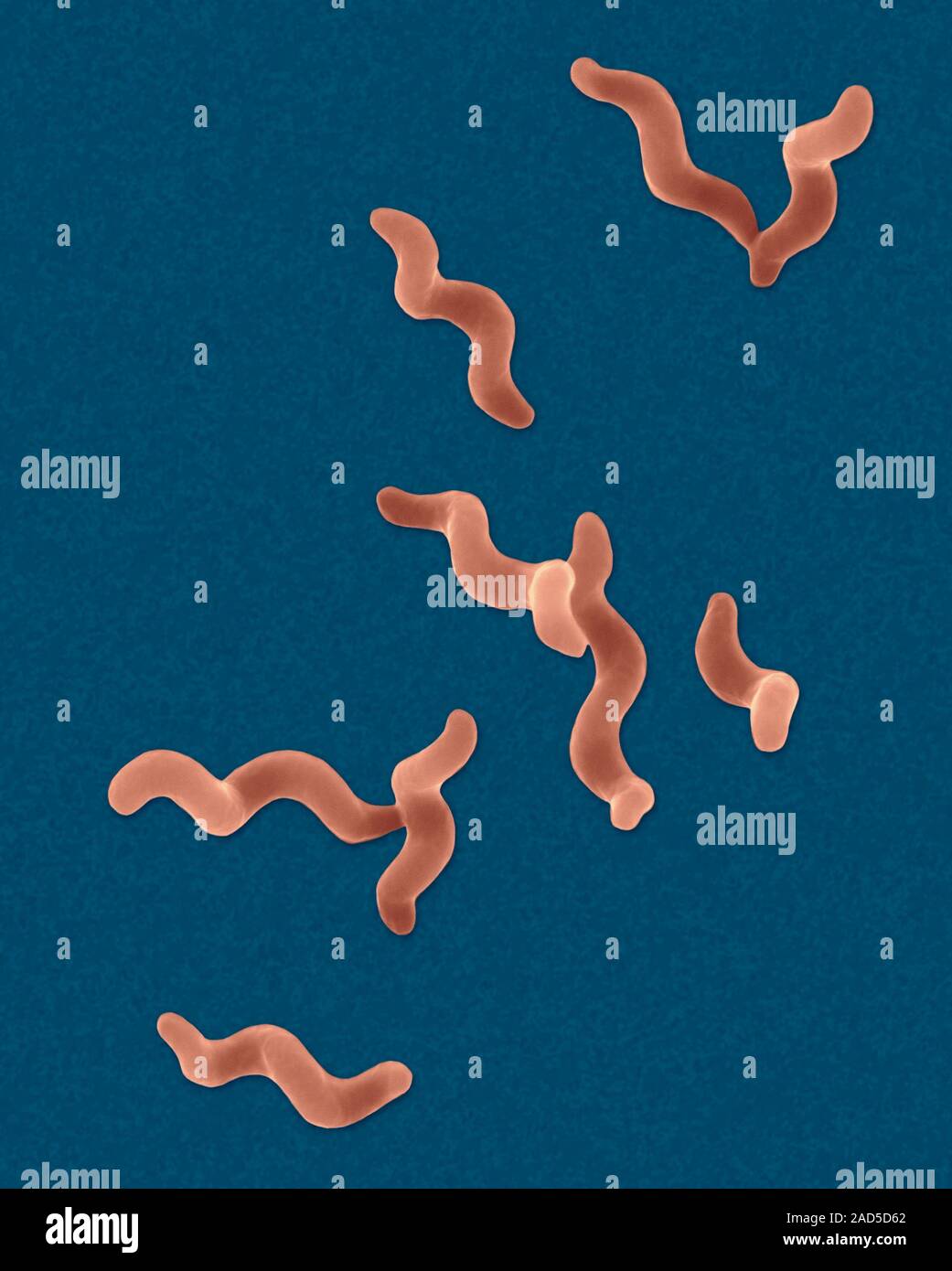 Coloured scanning electron micrograph (SEM) of Campylobacter jejuni is ...