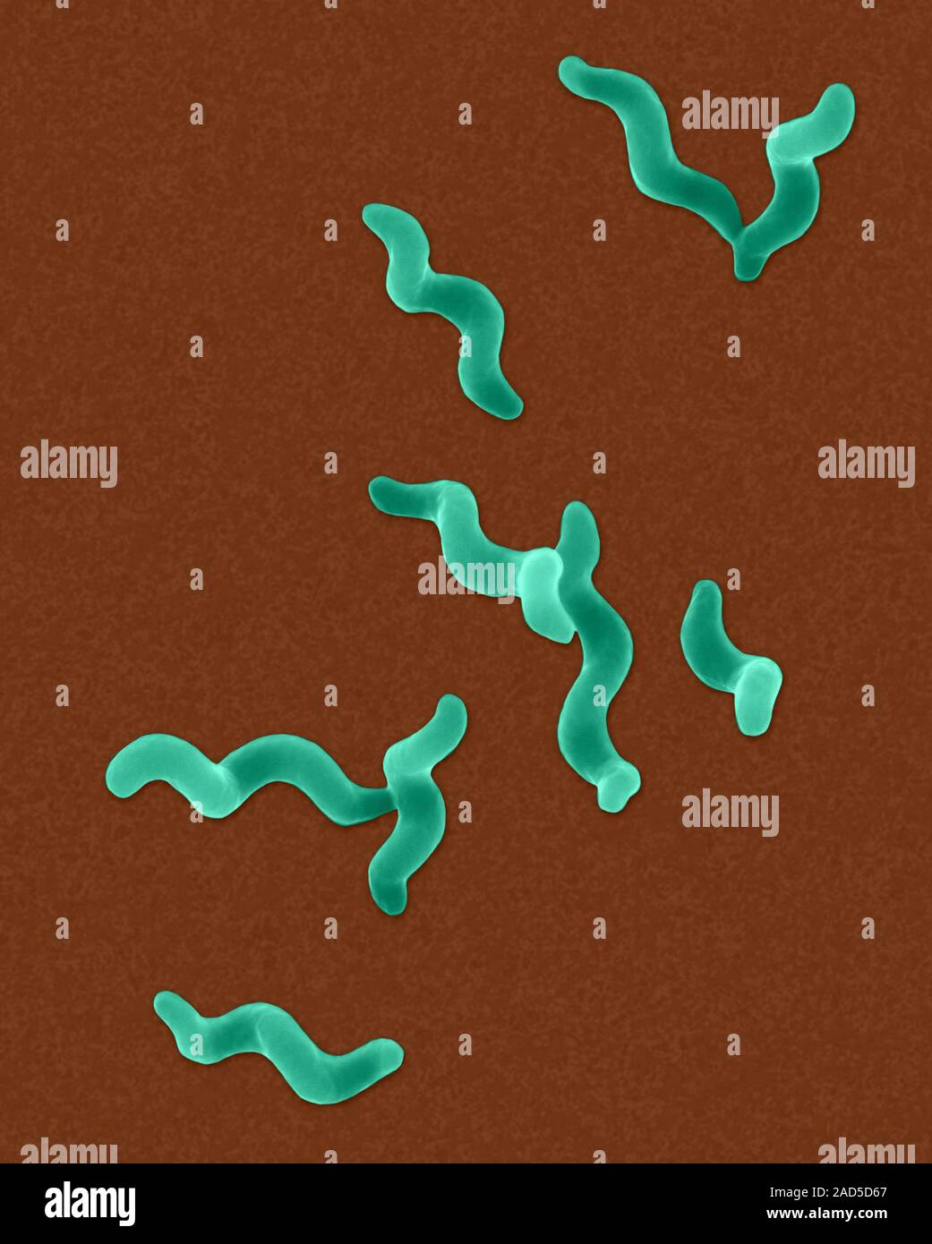 Coloured scanning electron micrograph (SEM) of Campylobacter jejuni is ...