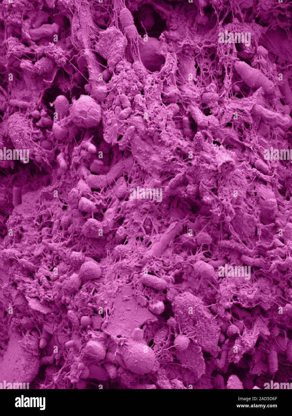 Coloured scanning electron micrograph (SEM) of Human intestinal ...