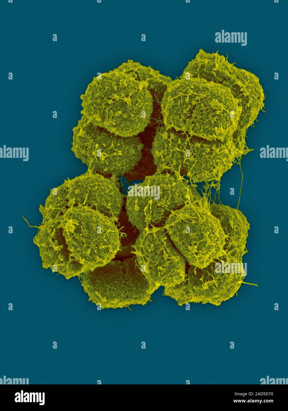 Coloured scanning electron micrograph (SEM) of Micrococcus antarcticus ...