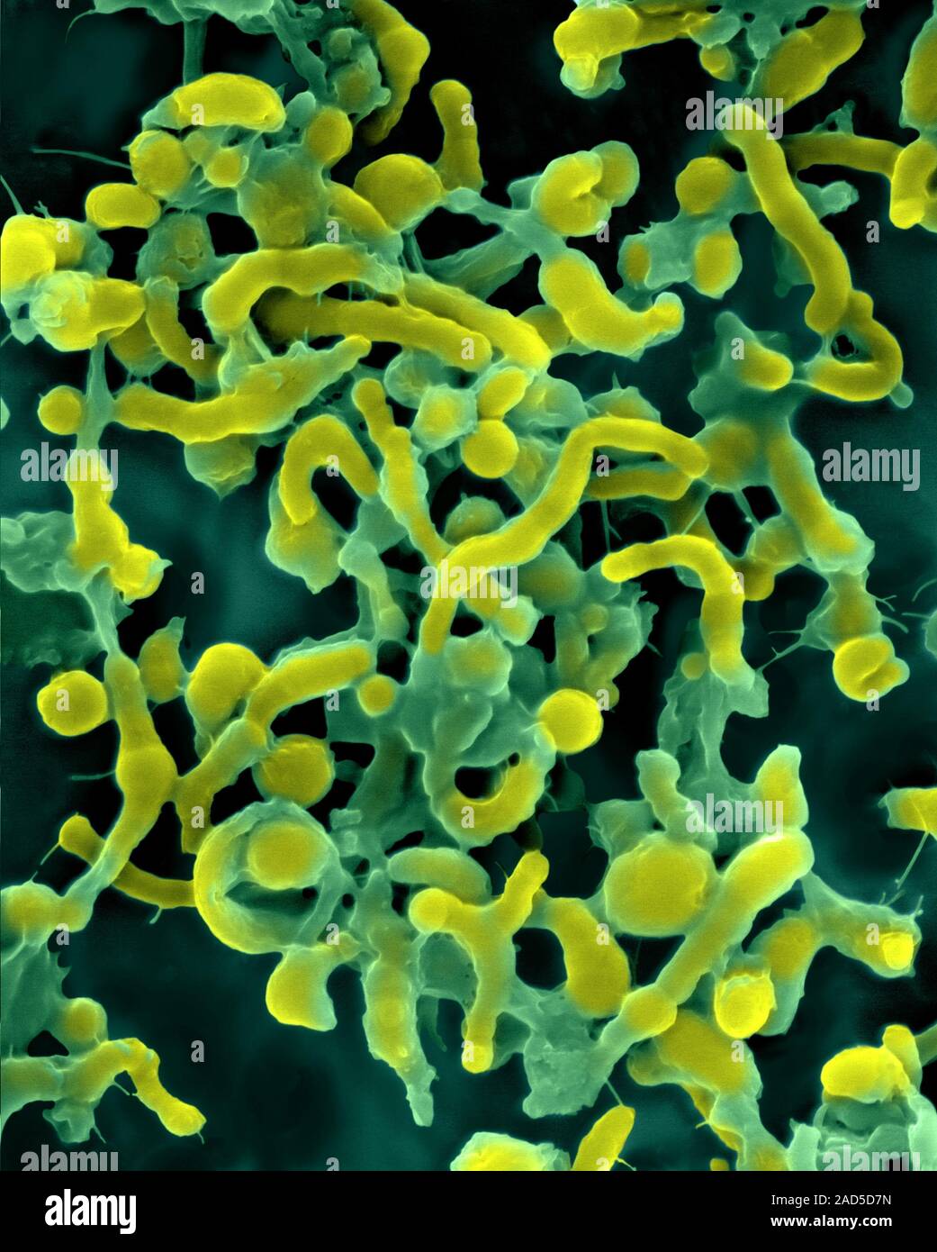 Coloured scanning electron micrograph (SEM) of Helicobacter pylori ...