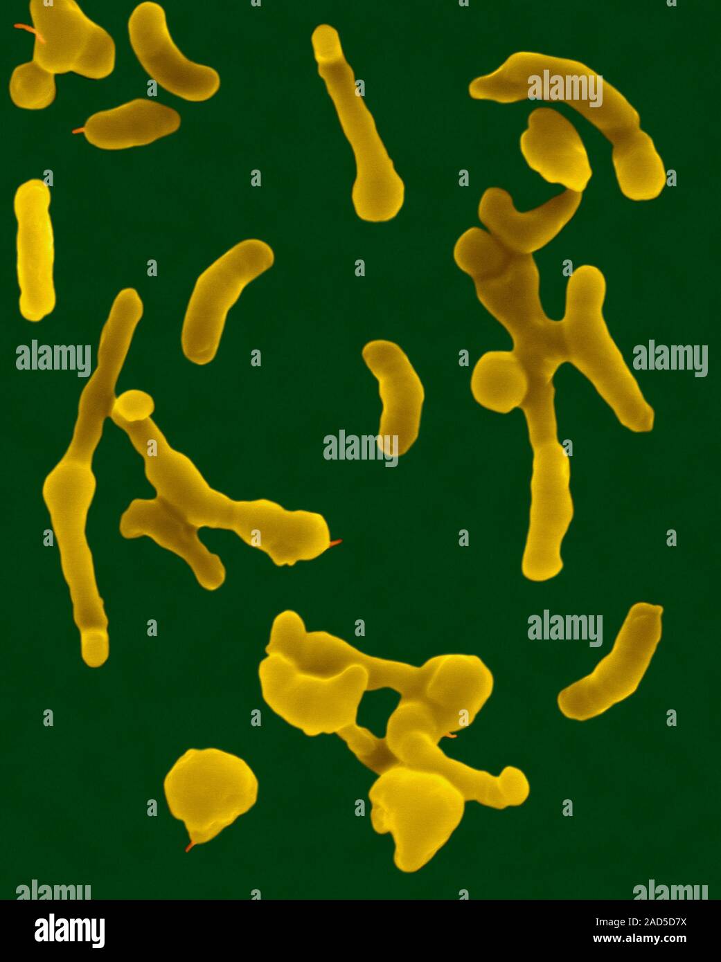 Coloured scanning electron micrograph (SEM) of Helicobacter pylori ...