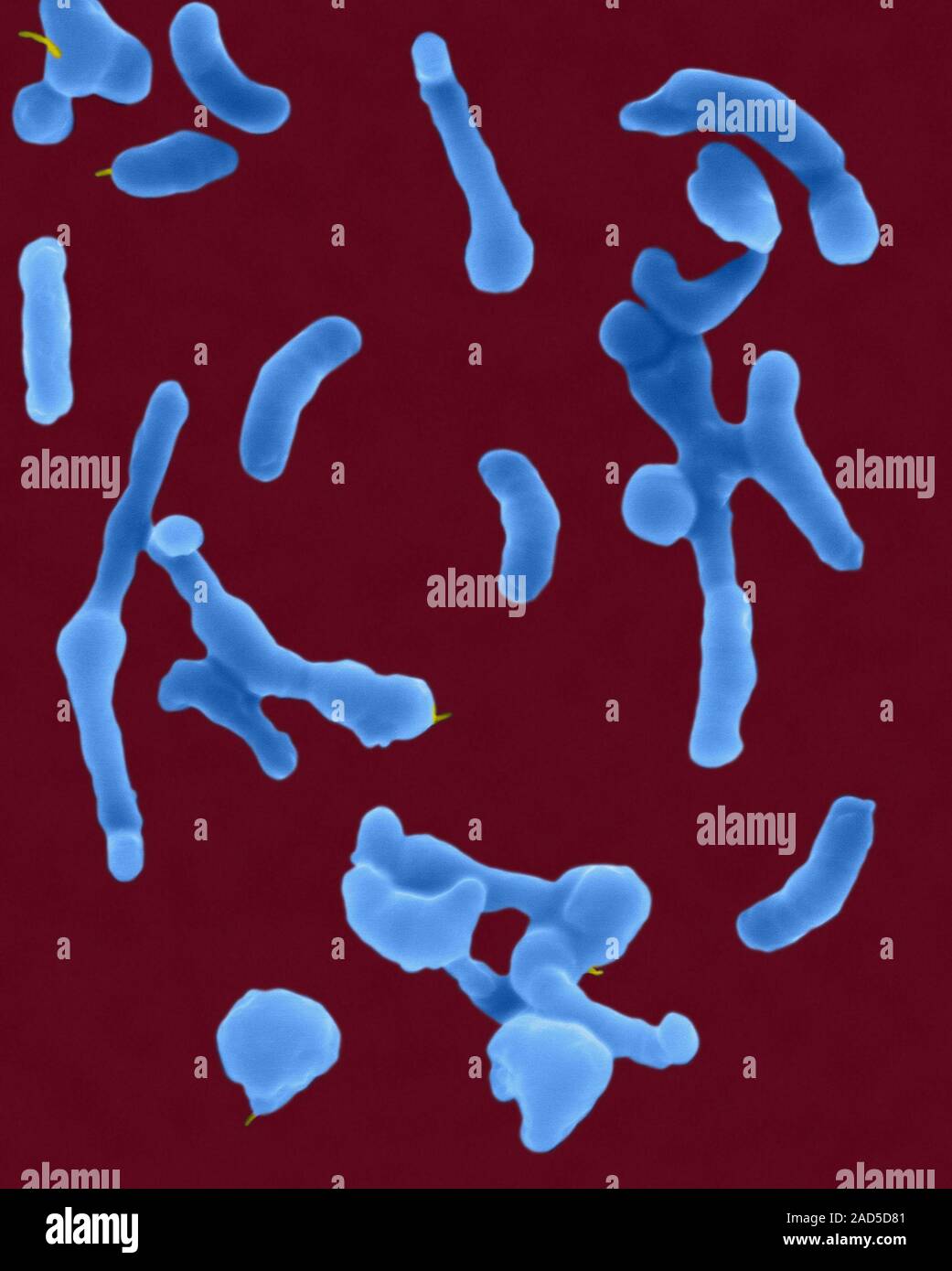 Coloured scanning electron micrograph (SEM) of Helicobacter pylori ...