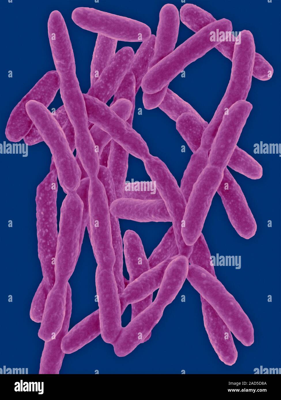 Coloured scanning electron micrograph (SEM) of Wood degrading bacterium ...