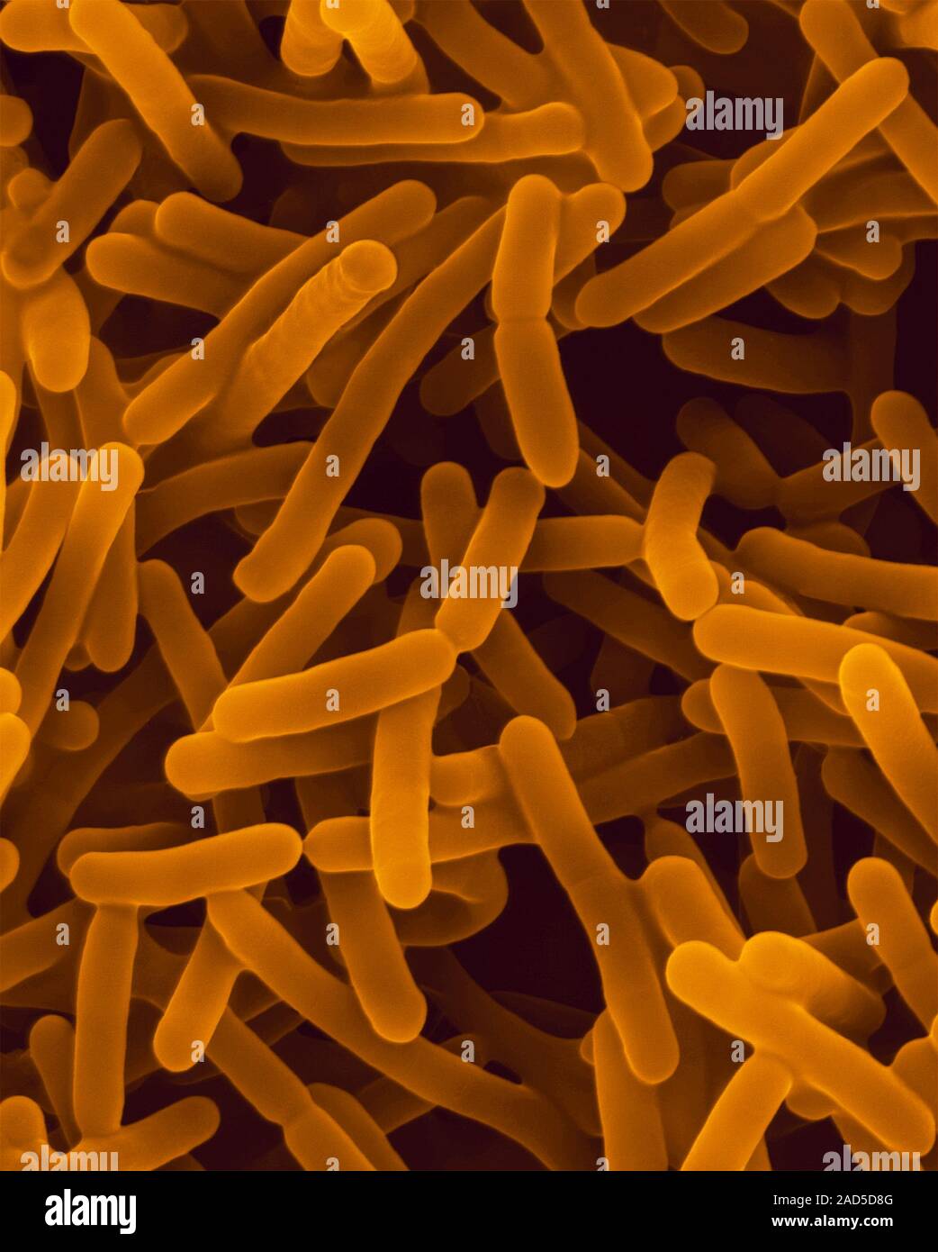 Coloured scanning electron micrograph (SEM) of Human intestine ...