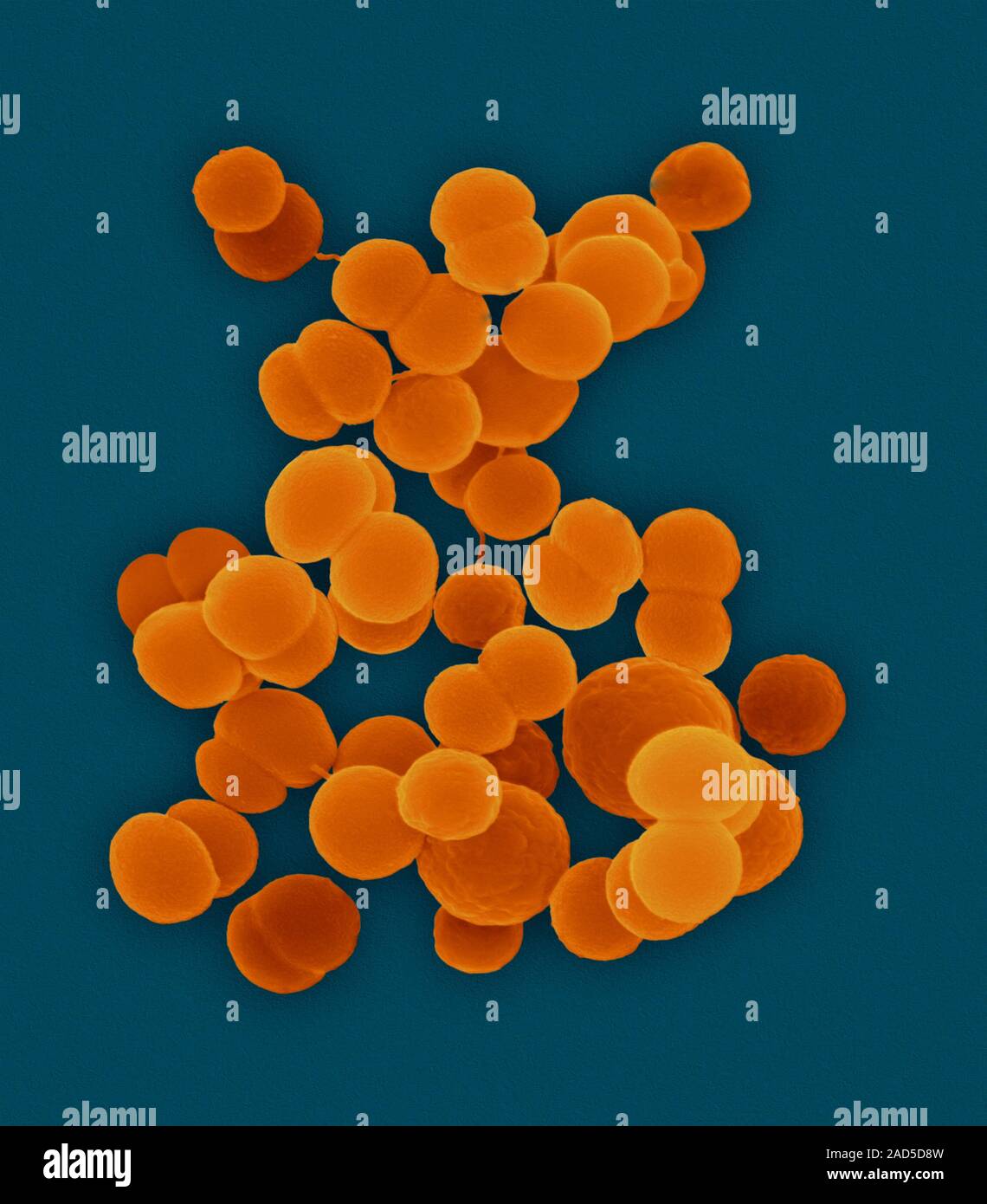 Coloured scanning electron micrograph (SEM) of Neisseria mucosa, Gram ...