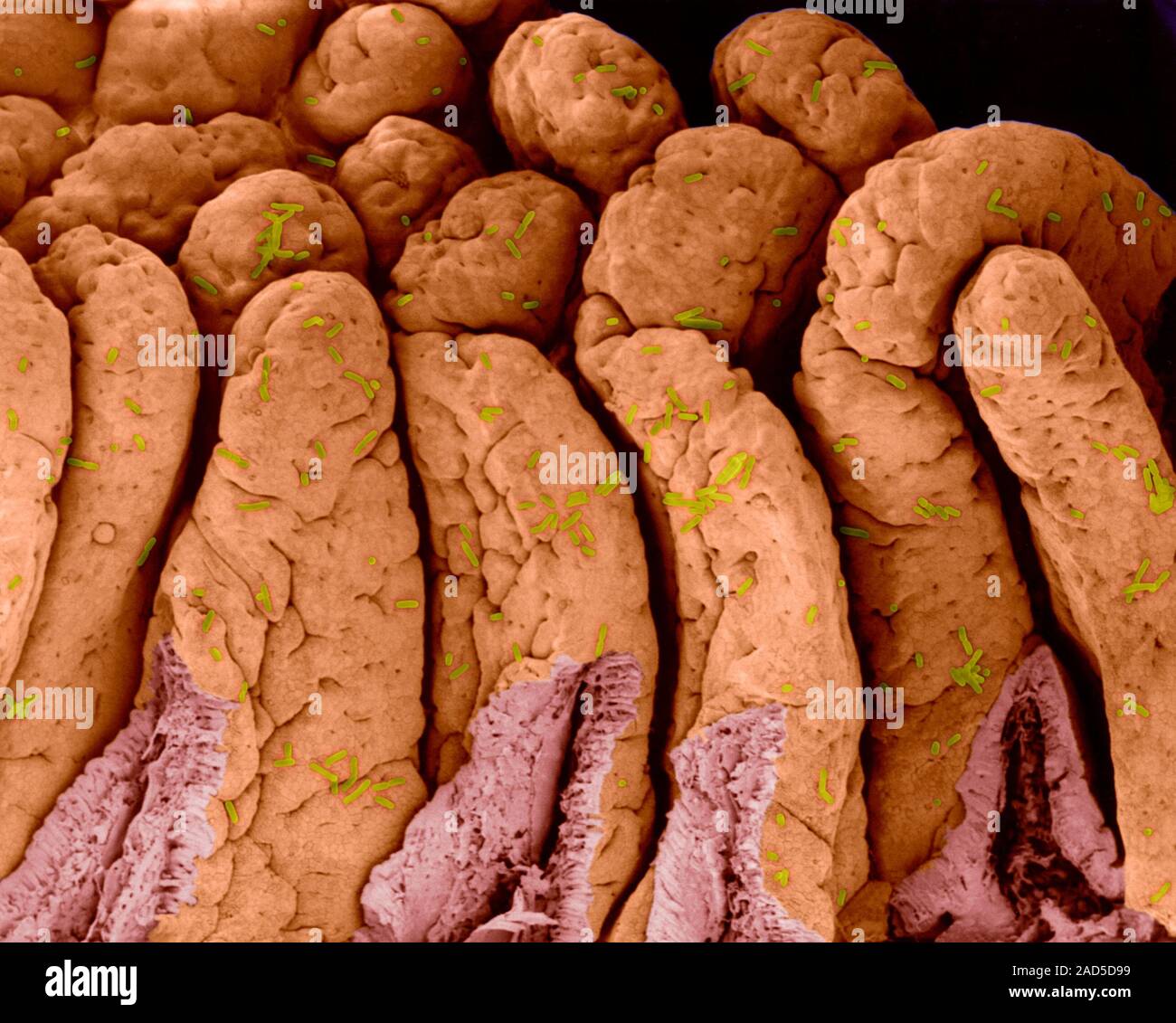 Coloured scanning electron micrograph (SEM) of Photocomposite, E. coli ...