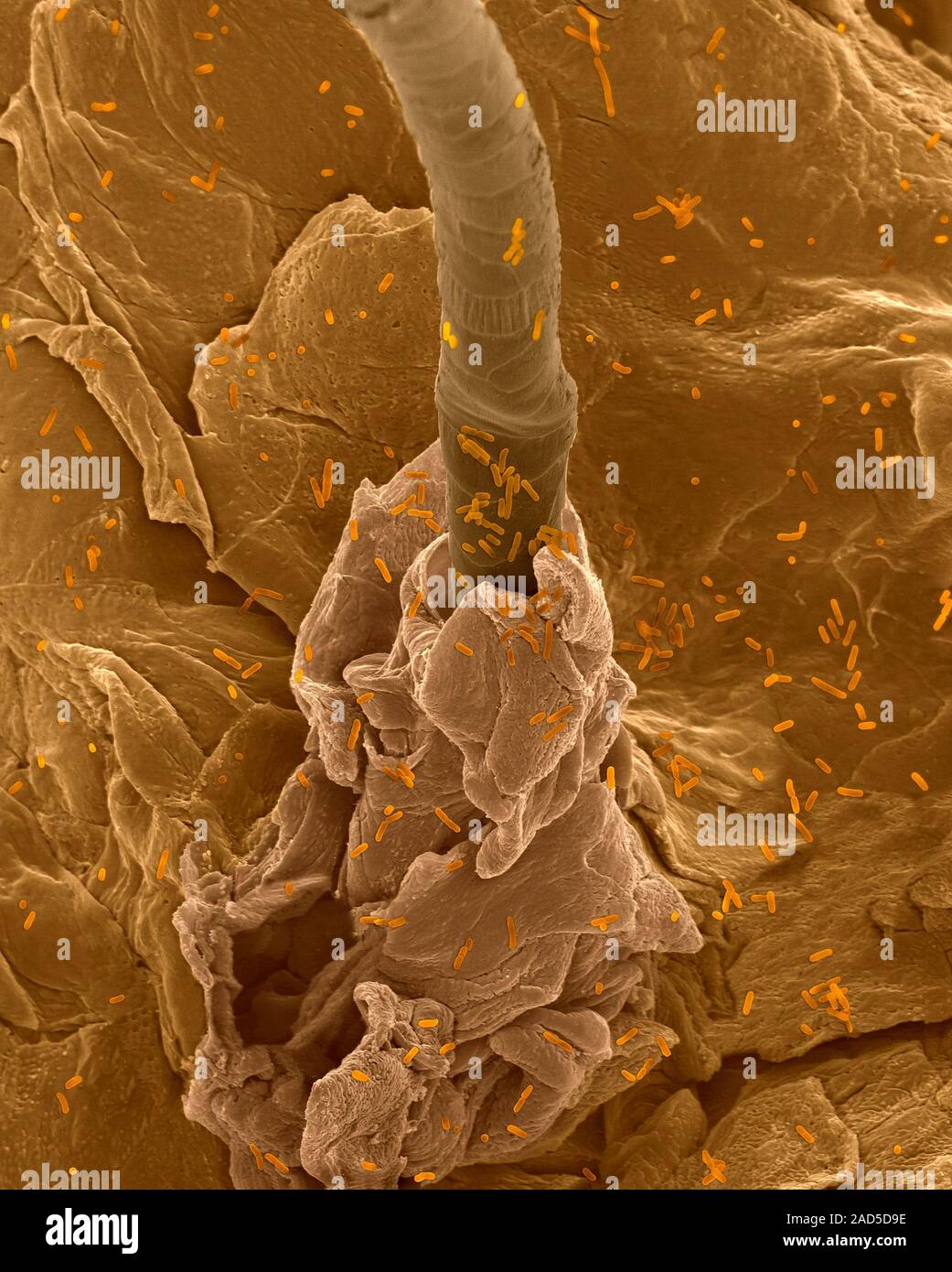 Coloured scanning electron micrograph (SEM) of Photocomposite, E. coli ...