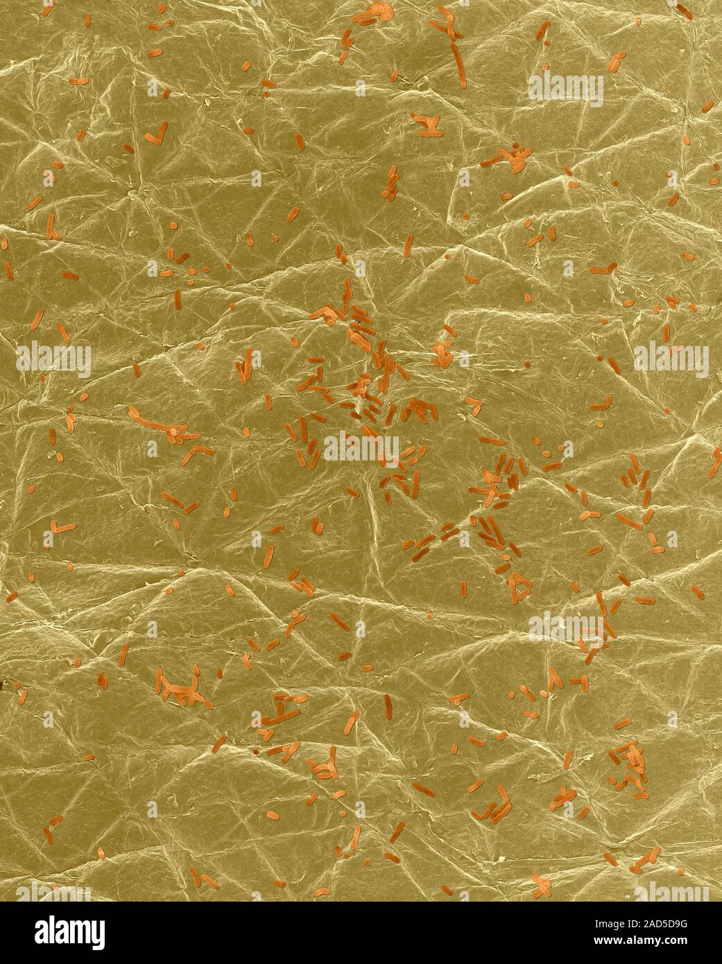 Coloured scanning electron micrograph (SEM) of Photocomposite, E. coli ...