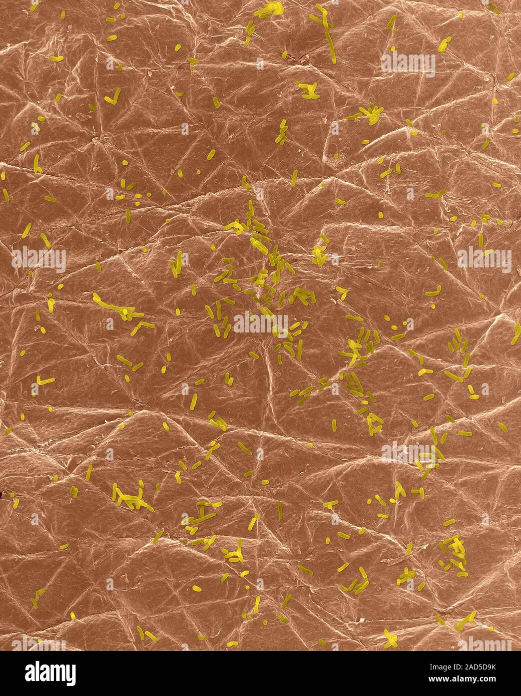 Coloured scanning electron micrograph (SEM) of Photocomposite, E. coli ...
