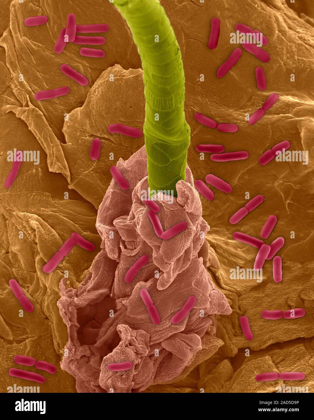 Coloured scanning electron micrograph (SEM) of Photocomposite, E. coli ...