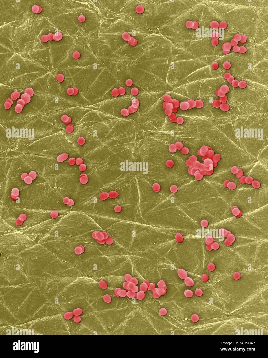 Coloured scanning electron micrograph (SEM) of Photocomposite ...