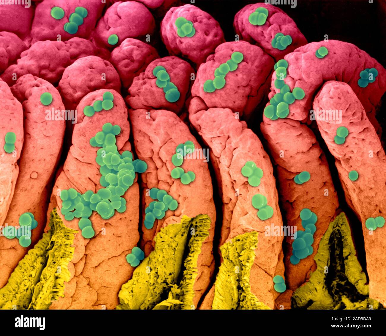 Coloured Scanning Electron Micrograph Sem Of Photocomposite Staphylococcus Aureus On The