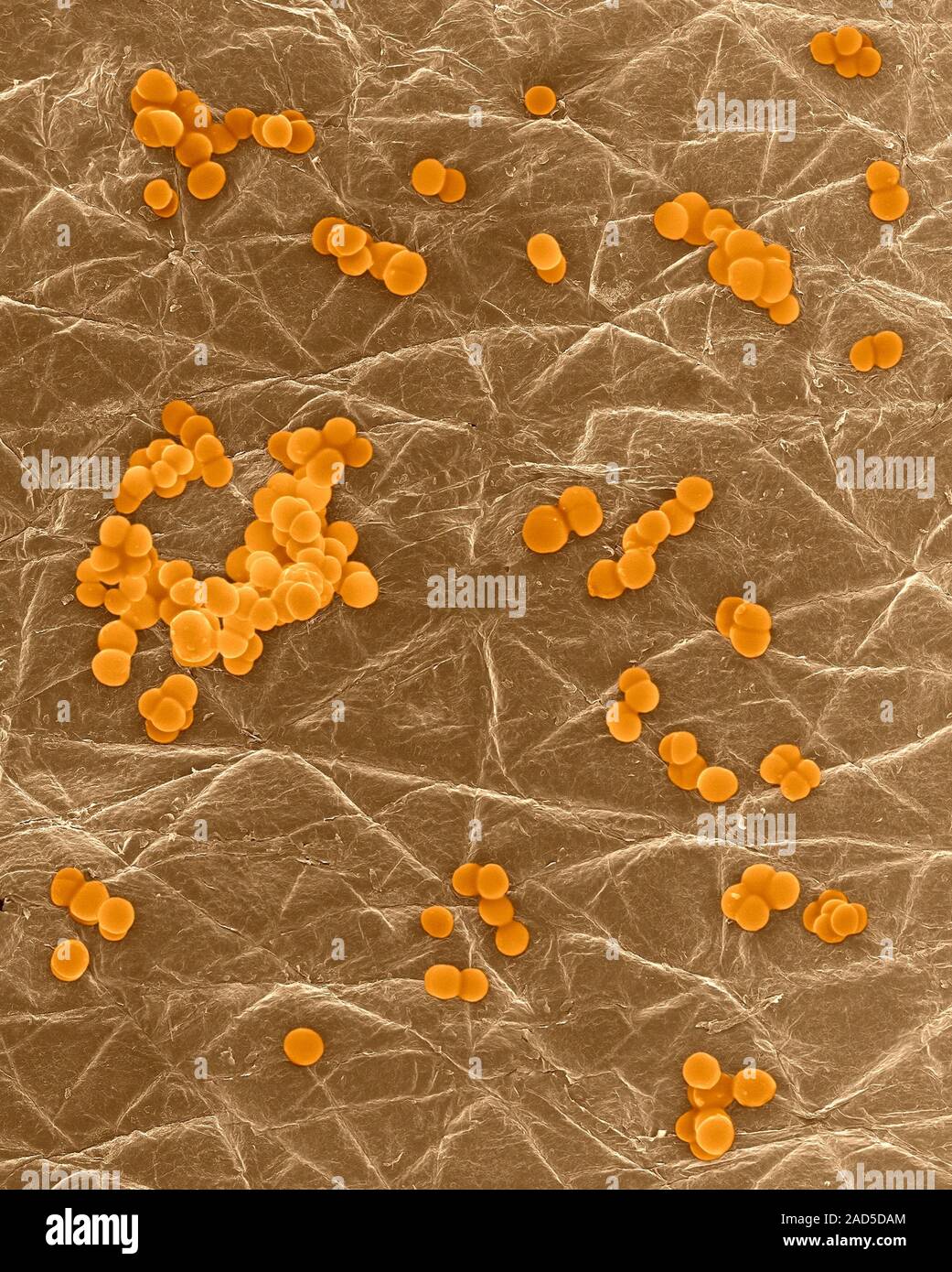 Coloured scanning electron micrograph (SEM) of Photocomposite ...
