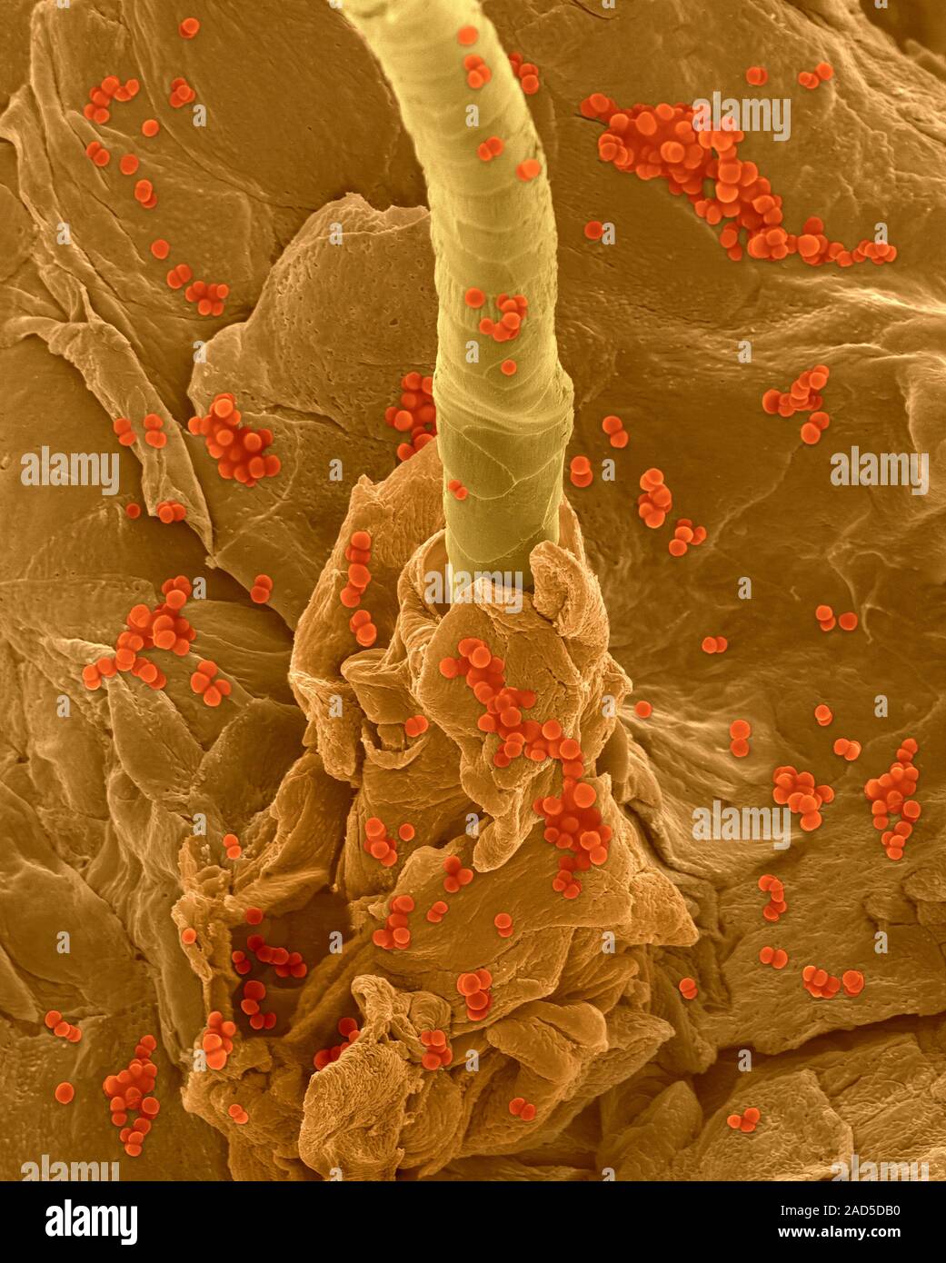 Coloured scanning electron micrograph (SEM) of Photocomposite ...