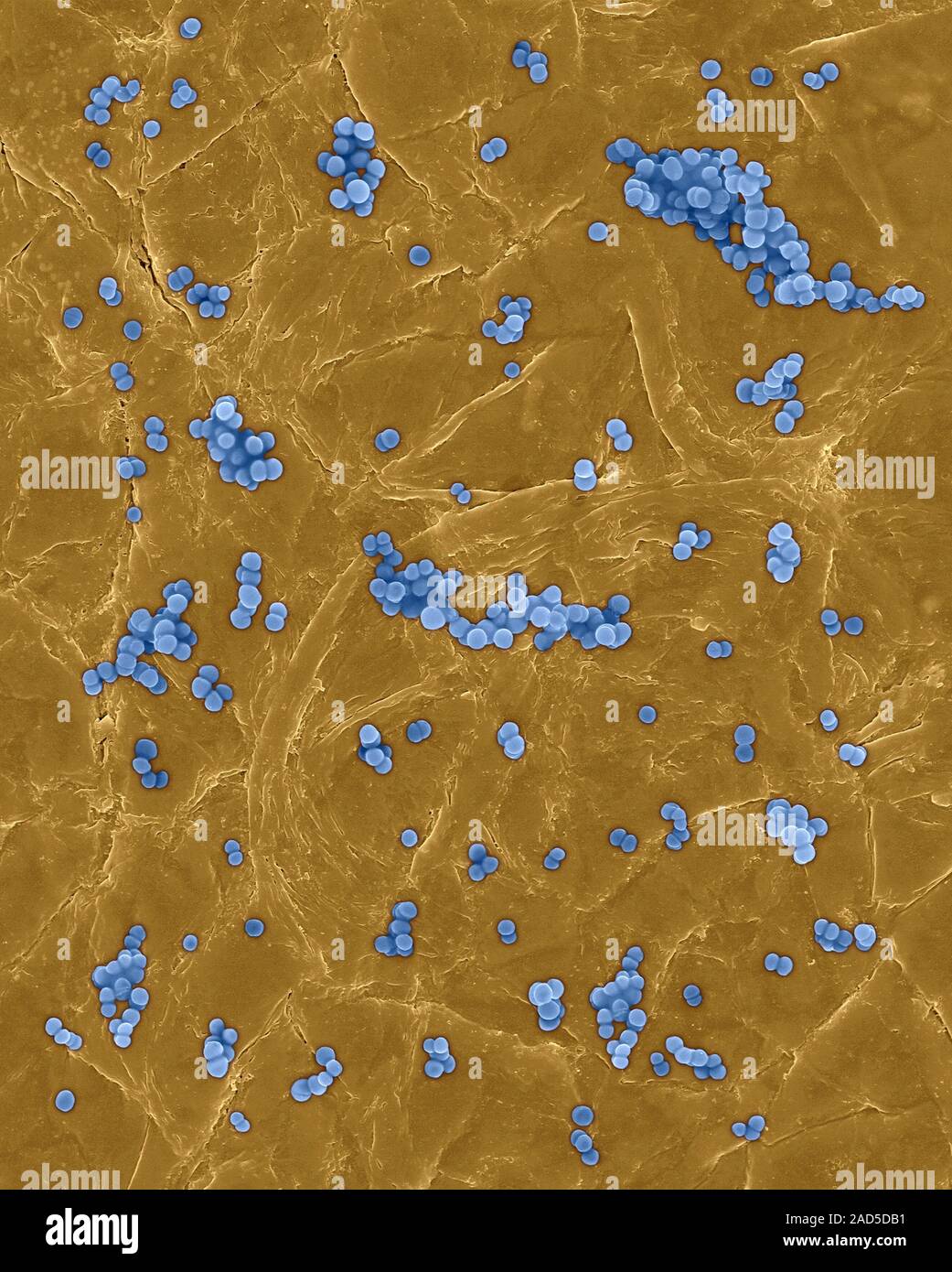 Coloured scanning electron micrograph (SEM) of Photocomposite ...