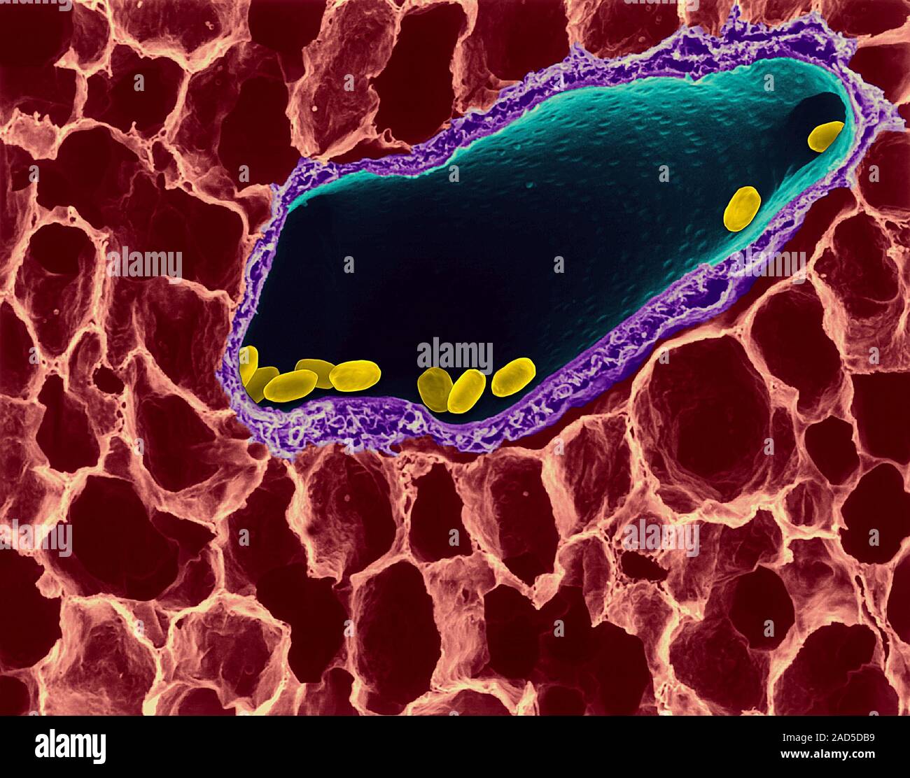 Coloured Scanning Electron Micrograph Sem Of Photocomposite Of Bacillus Anthracis Spores In