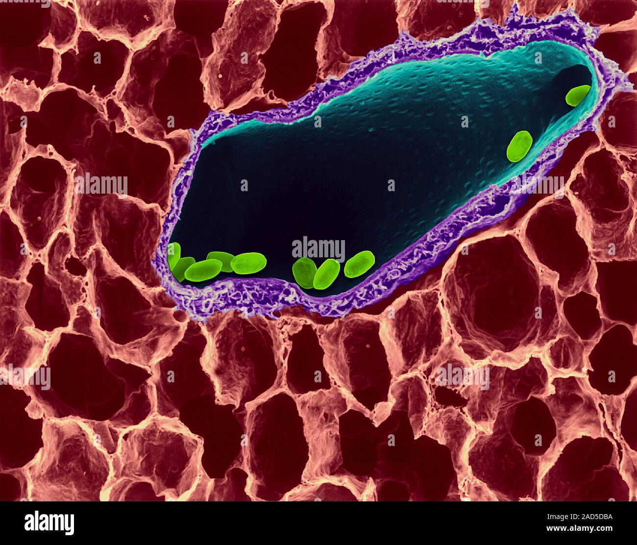 Coloured scanning electron micrograph (SEM) of Photocomposite of ...