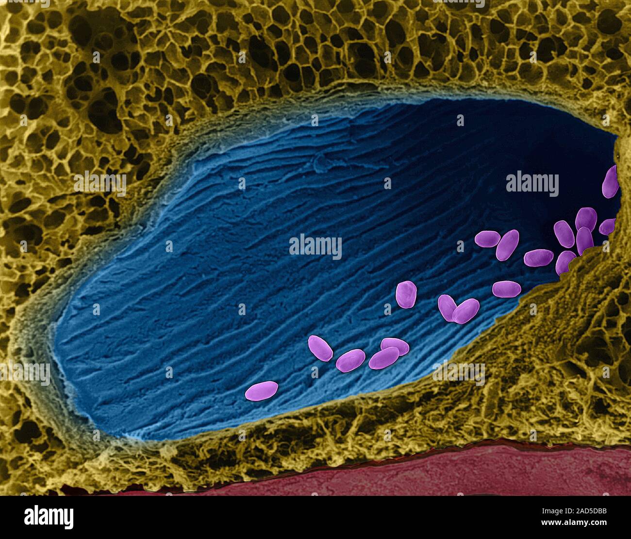 Coloured scanning electron micrograph (SEM) of Photocomposite of ...