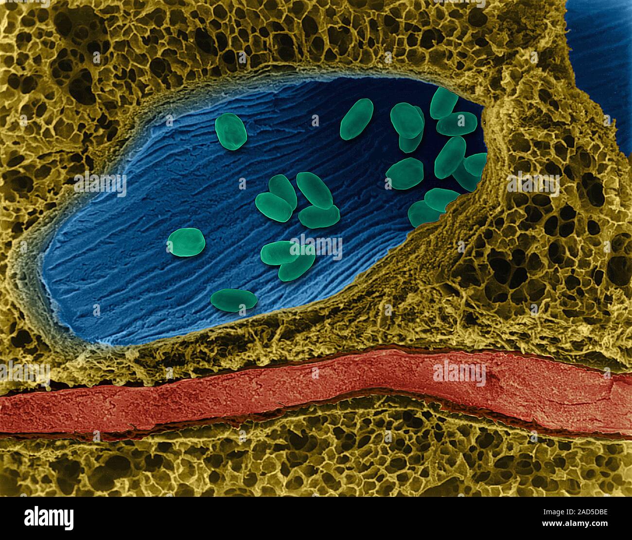 Coloured scanning electron micrograph (SEM) of Photocomposite of ...