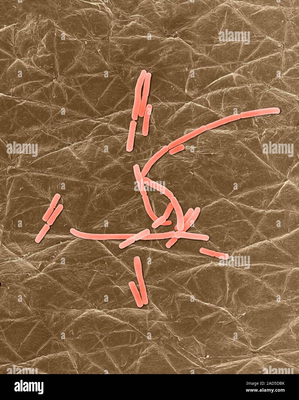 Coloured scanning electron micrograph (SEM) of Bacillus anthracis ...