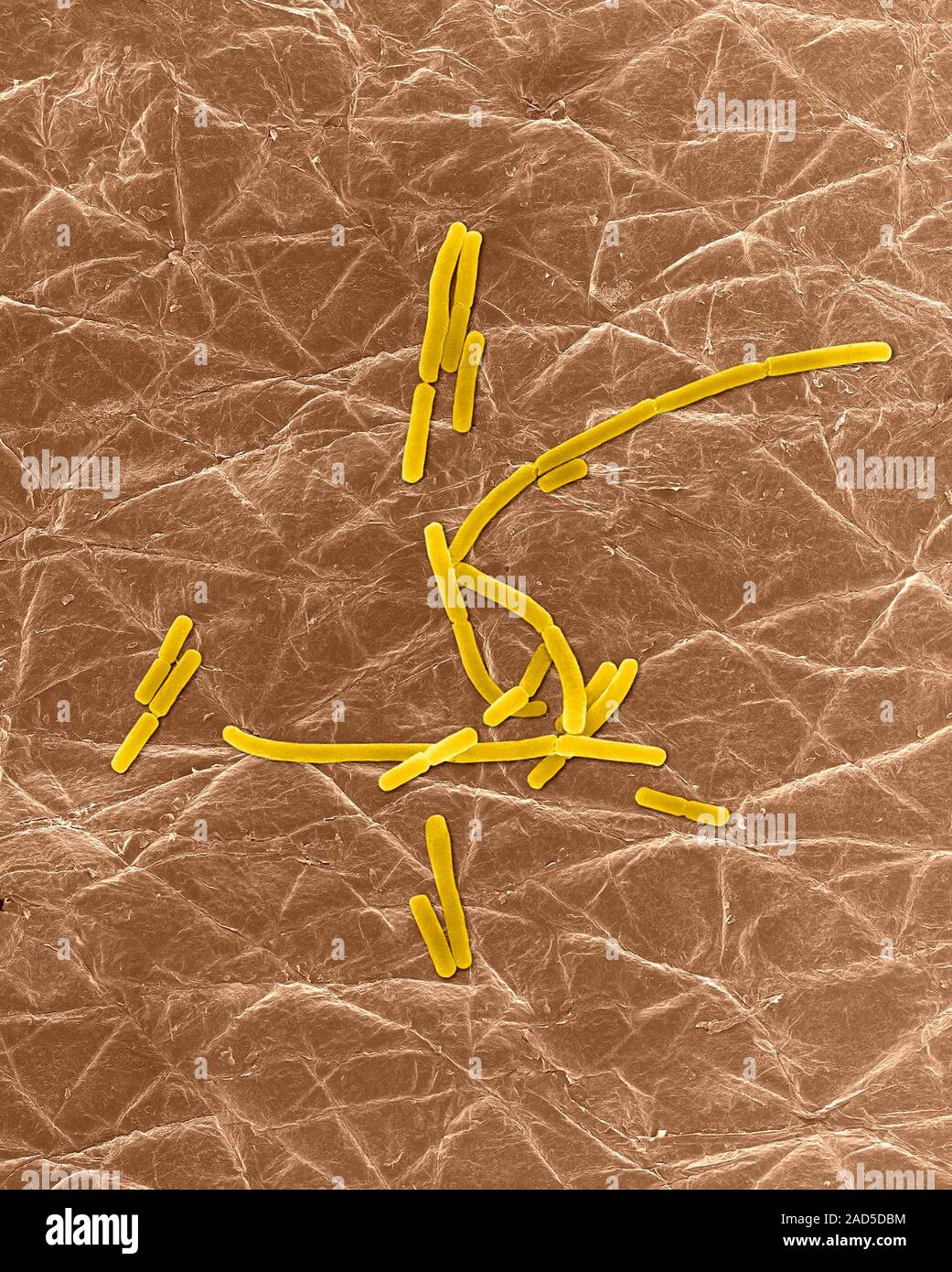 Coloured scanning electron micrograph (SEM) of Bacillus anthracis ...